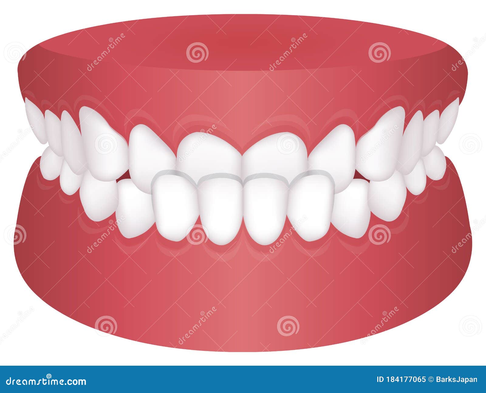 Teeth Trouble Bite Type Vector Illustration /Underbite Stock Vector ...