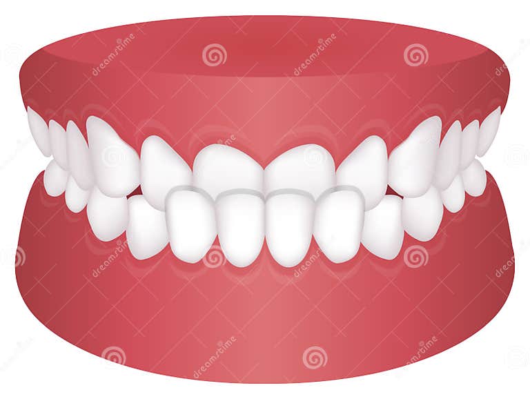Teeth Trouble Bite Type Vector Illustration /Underbite Stock Vector ...