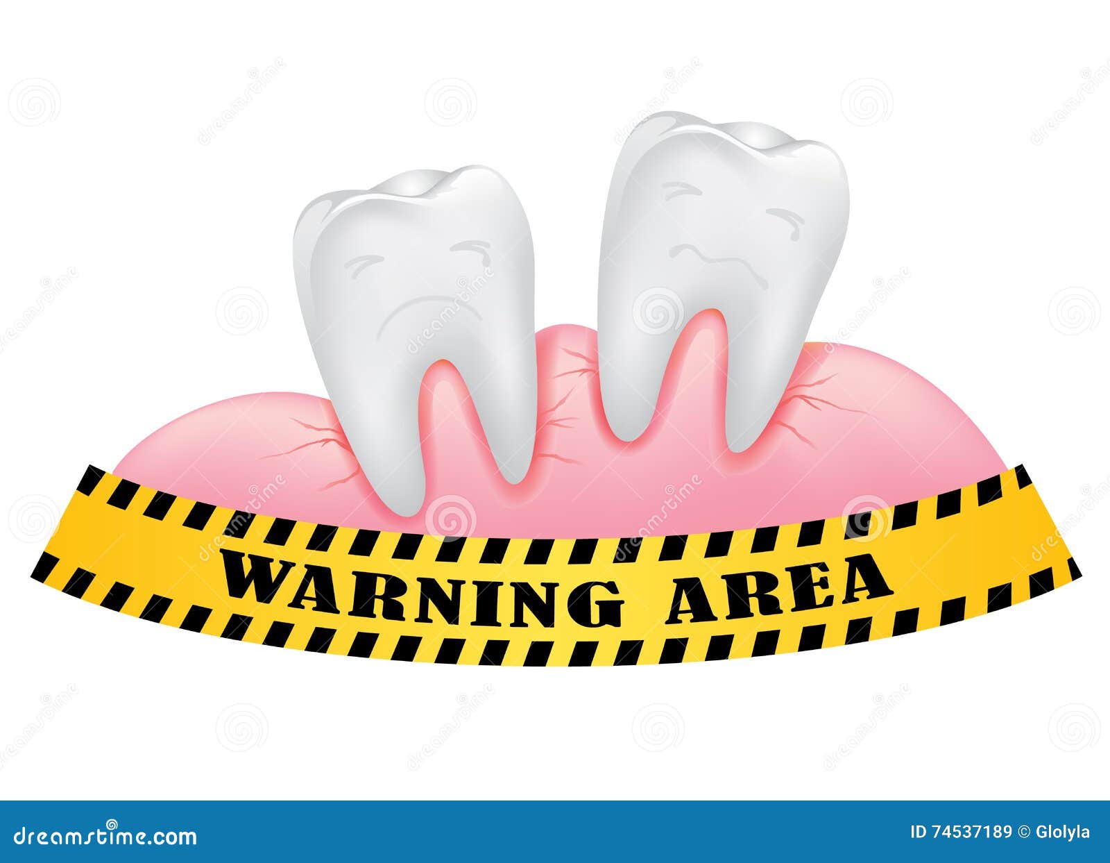 Teeth with warning area stock vector. Illustration of expertise - 74537189