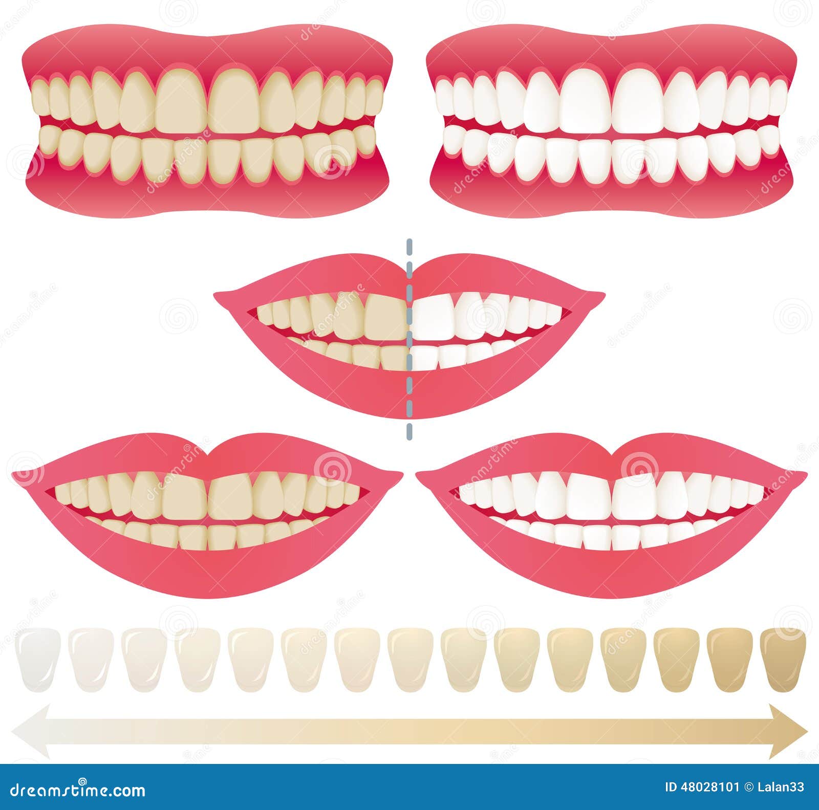 Teeth whitening. stock vector. Illustration of tooth - 48028101