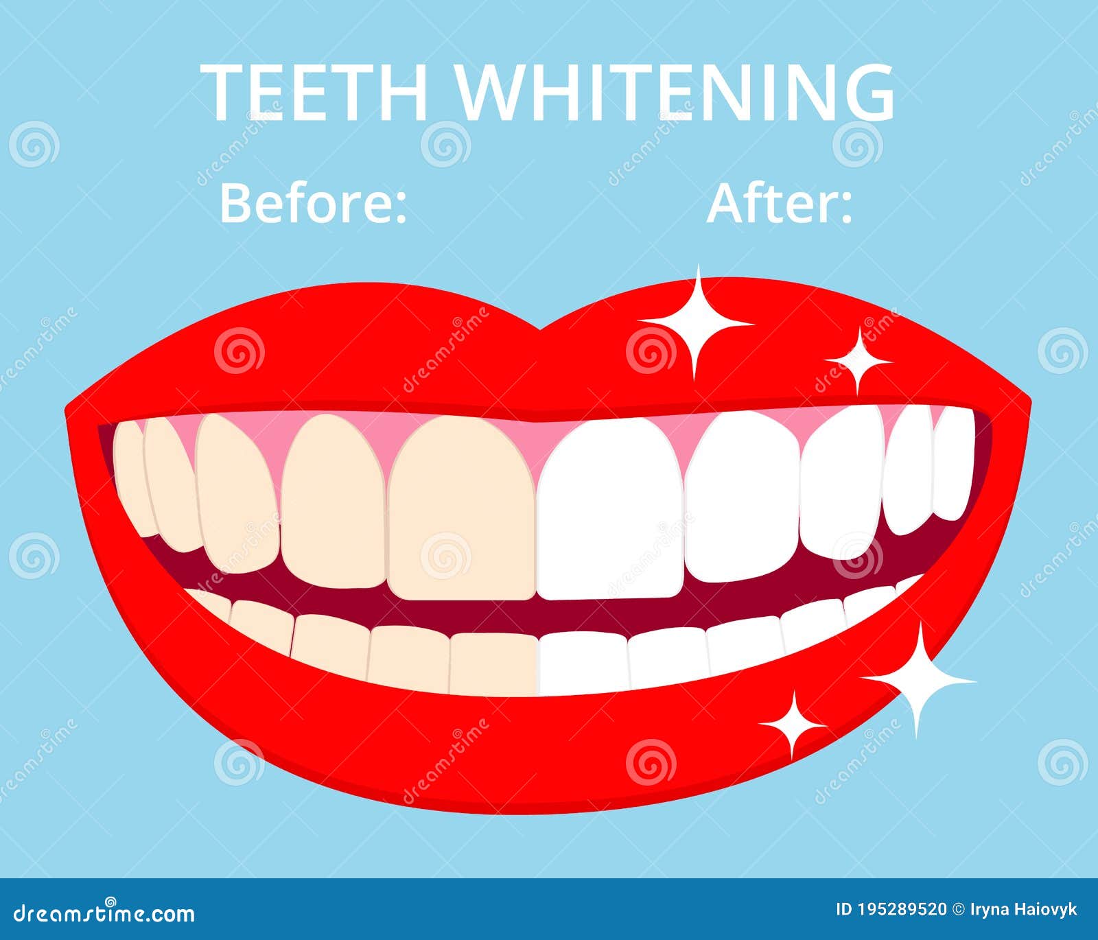 Teeth Whitening Concept Woth Laughed Mouse and Teeth before and after ...