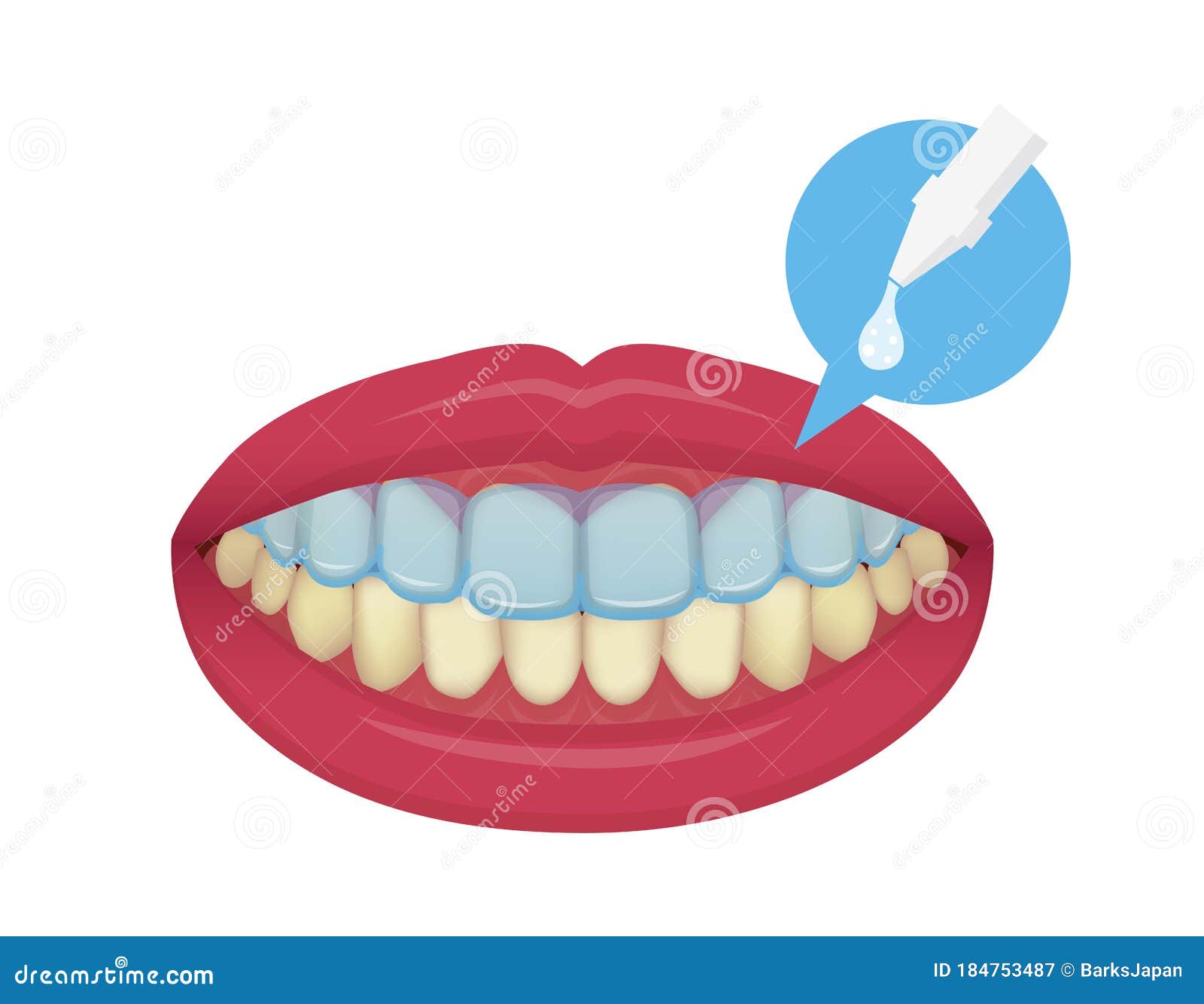 Teeth Whitening at Home Vector Illustration / No Text Stock Vector ...