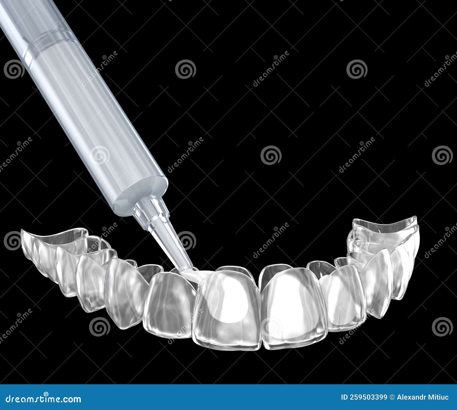 Teeth Whitening Kit, Adding Gel in To Invisalign. 3D Illustration ...