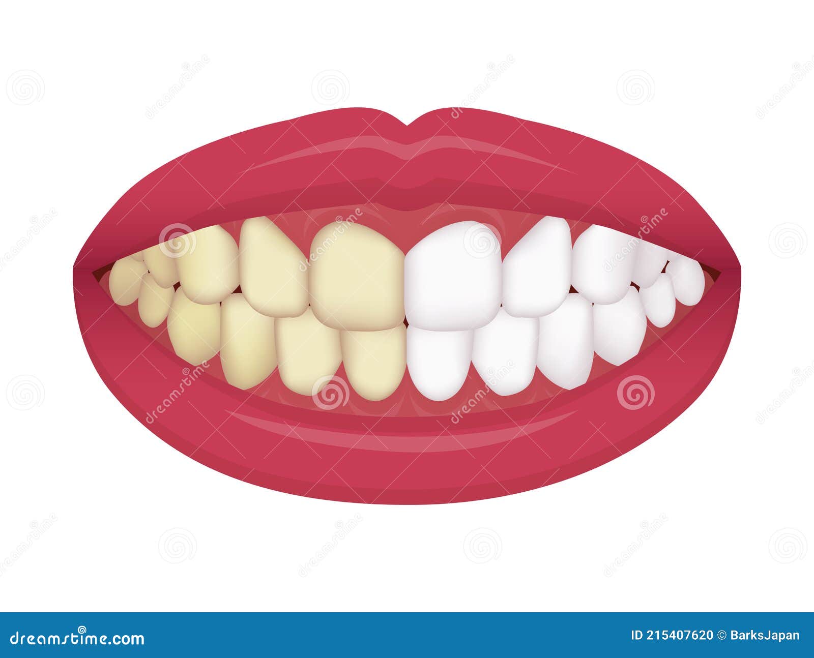 Teeth Whitening Vector Illustration / before and after Stock Vector ...