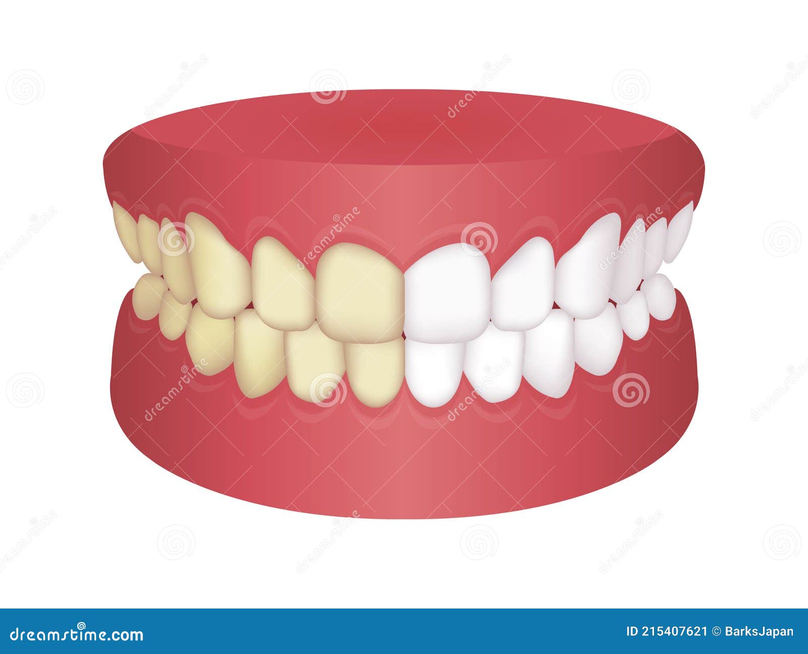Teeth Whitening Vector Illustration / before and after Stock Vector ...