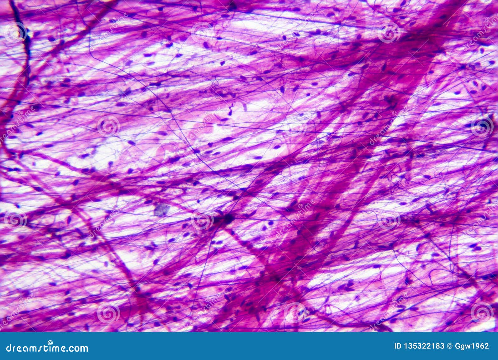 Tejido Conectivo Areolar 400x