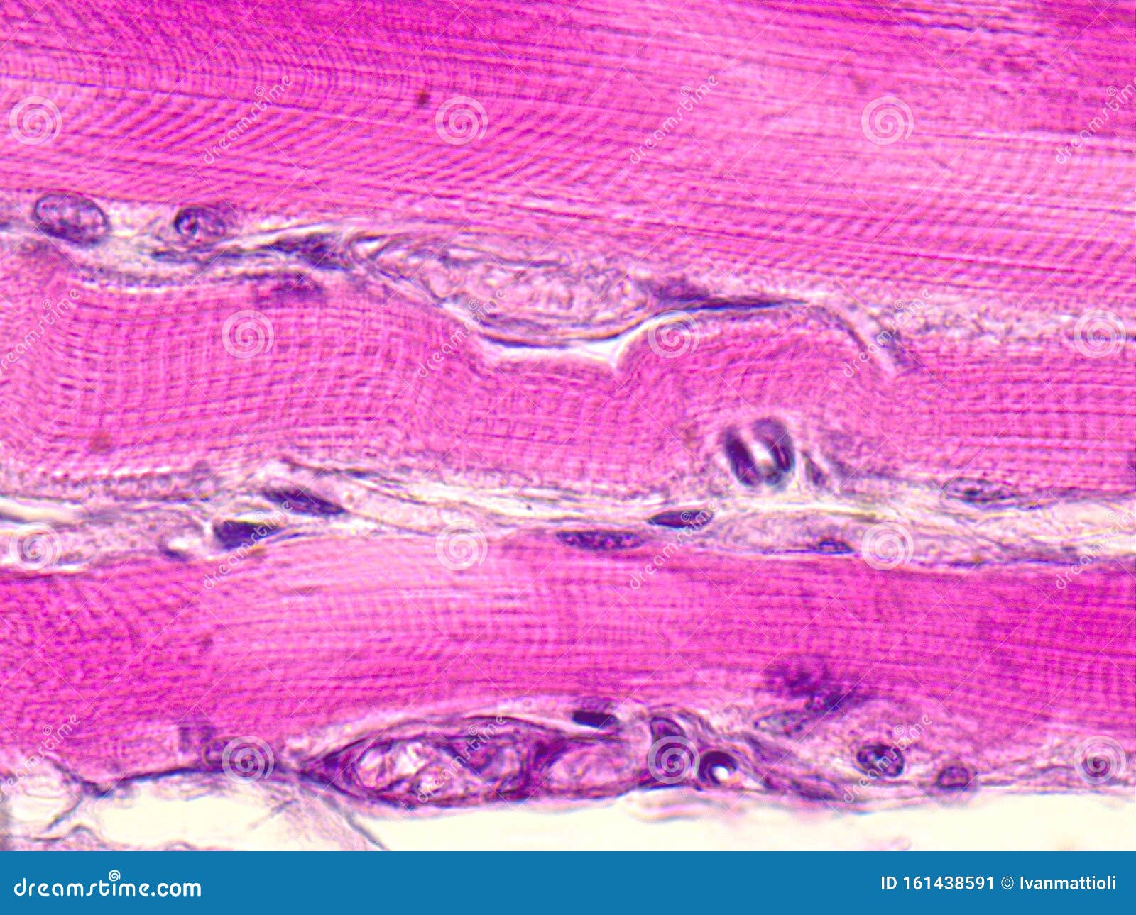 Tejido Muscular Estriado Esquelético Bajo El Microscopio Imagen de ... Tejido Muscular Estriado Esquelético Bajo El Microscopio Imagen de ...