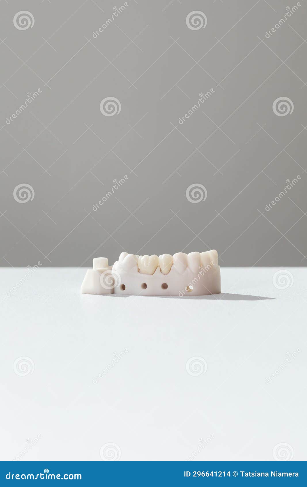Template Dental Cap or Tooth Crown on Implant Model Tooth Support ...