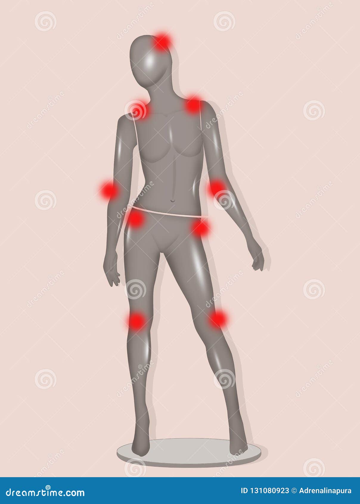 Tender Points Of Fibromyalgia With Pain Location On Body Outline ...