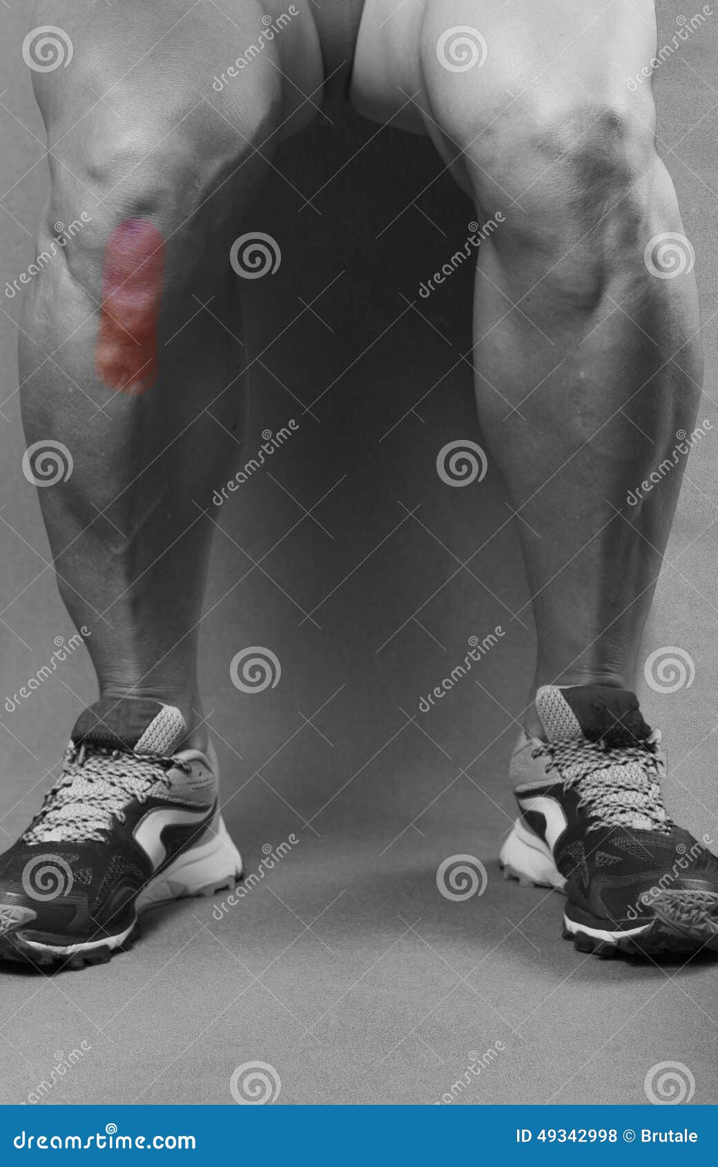 Tendinitis in the Patellar Tendon Stock Photo - Image of patellar, male ...
