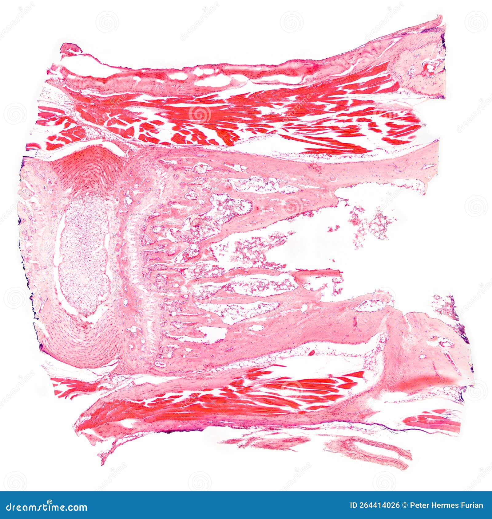 Tendon, a Piece of Sinew Section, he Stain, 20X Light Micrograph Stock ...