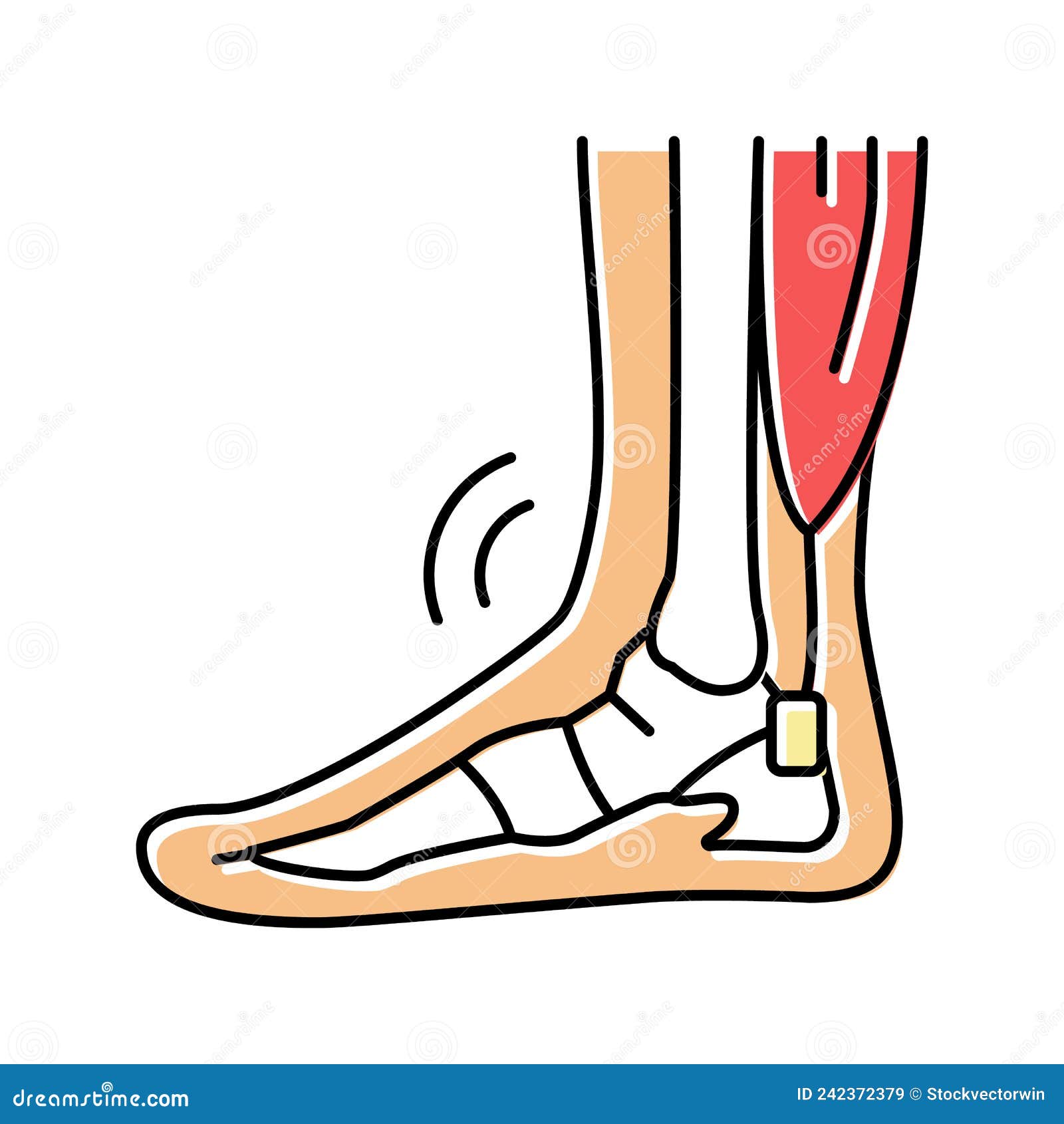 Tendonitis Color Line Icon. Pictogram For Web Page Vector Illustration ...