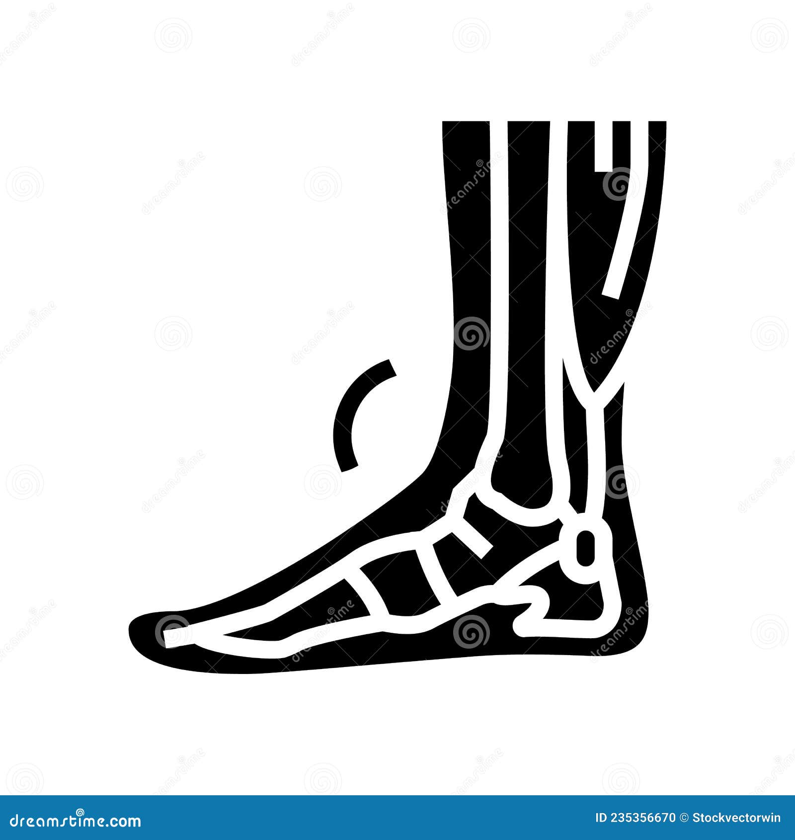 Tendonitis Problem Glyph Icon Vector Illustration Stock Vector ...