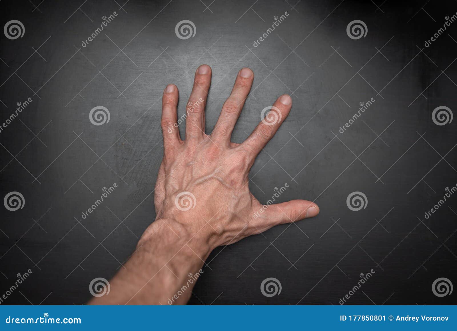 Veins Of Palm , Arm And Forearm By Infrared Vein Finder Royalty-Free ...