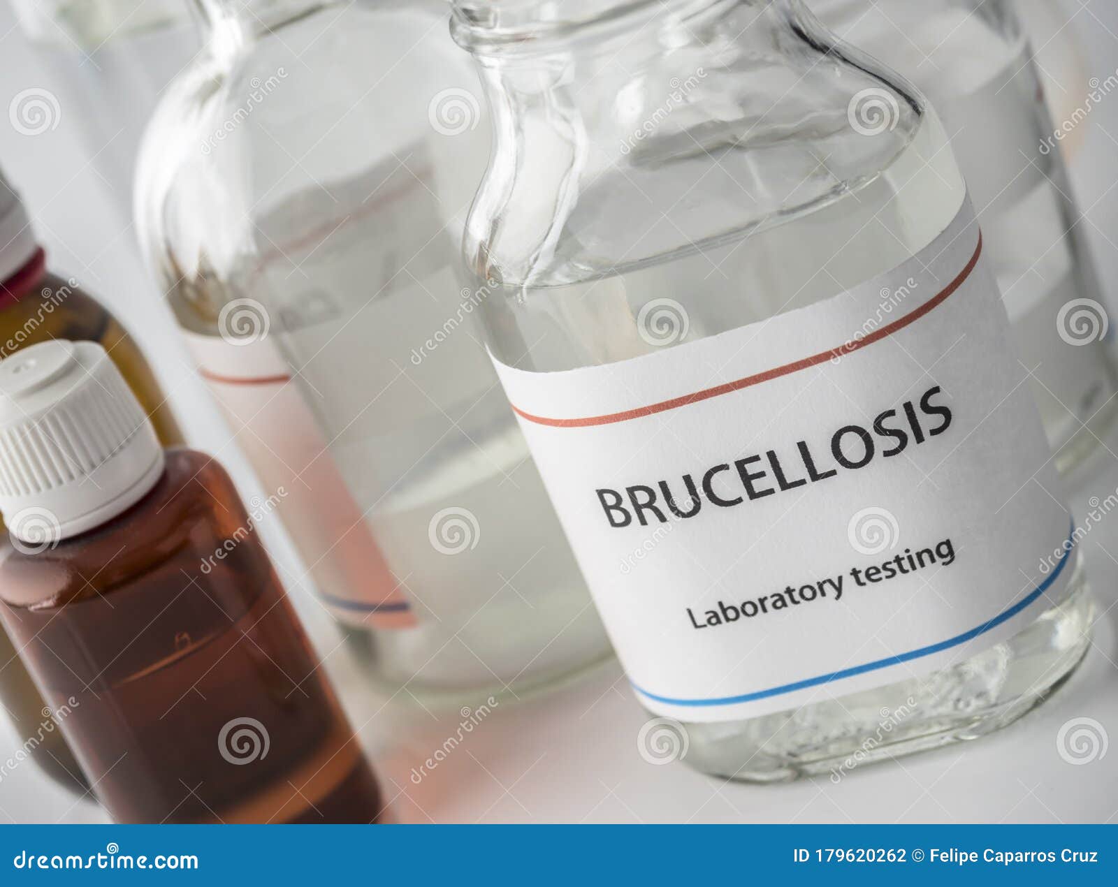 Test Brucellosis in Laboratory Stock Photo - Image of infection ...