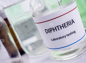 Test Diphtheria in Laboratory, Conceptual Image Stock Image - Image of ...