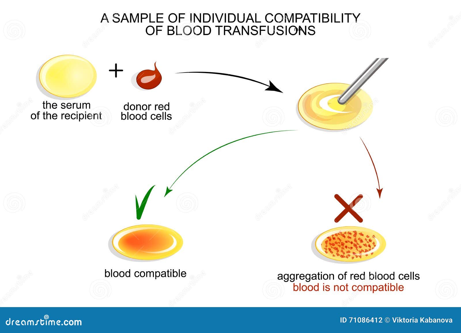 The Test on Individual Blood Compatibility Stock Vector - Illustration ...