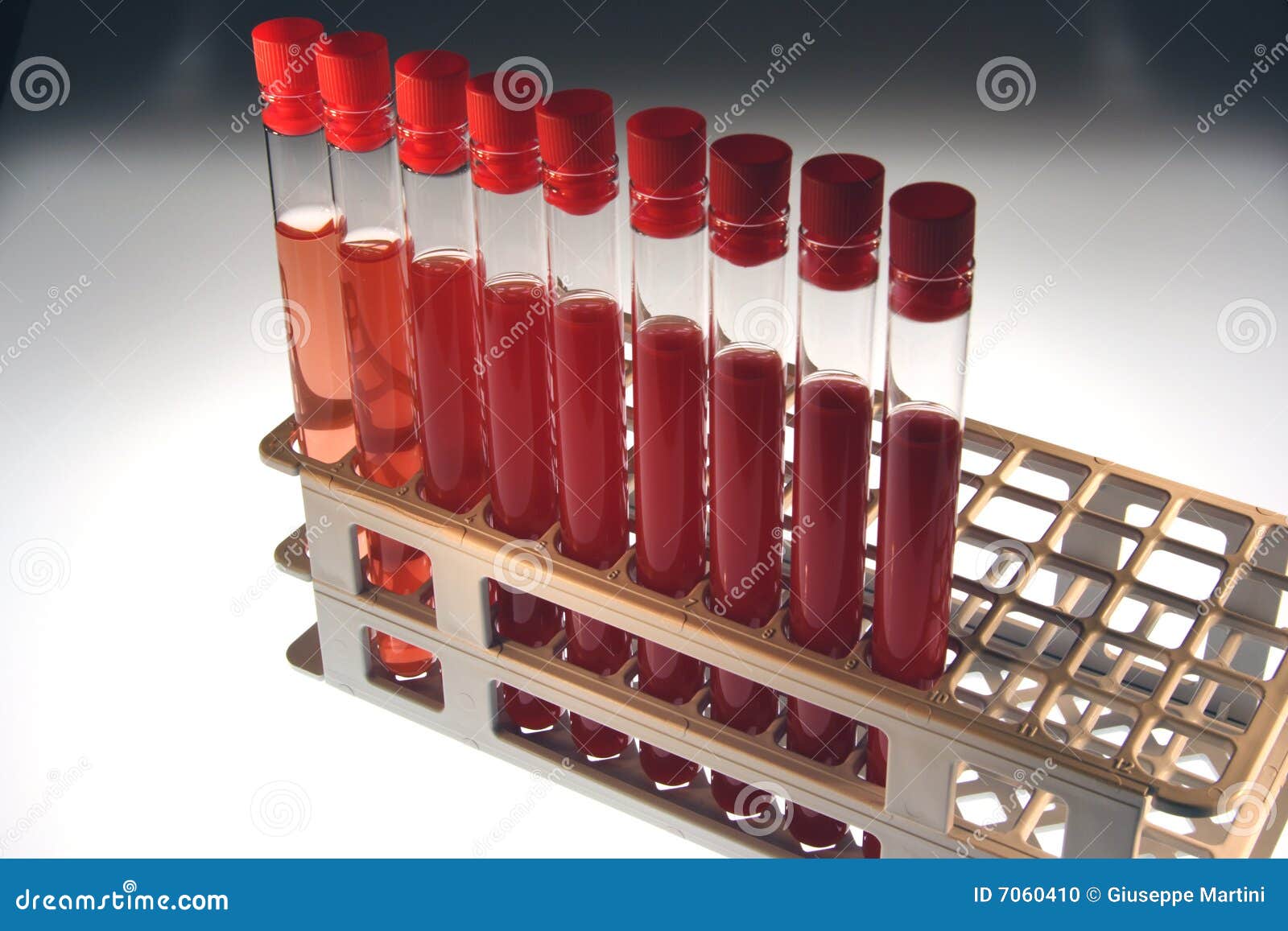 Test tube stock photo. Image of test, health, blood, specimen - 7060410