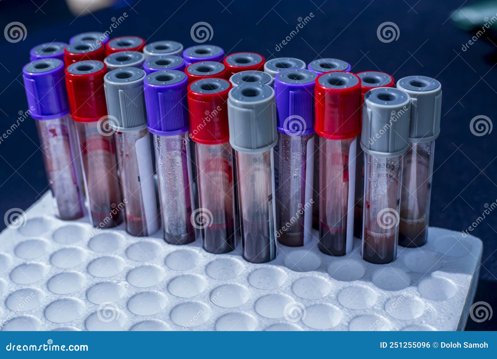 The Test Tube in the Blood Test Stock Photo - Image of organ, water ...