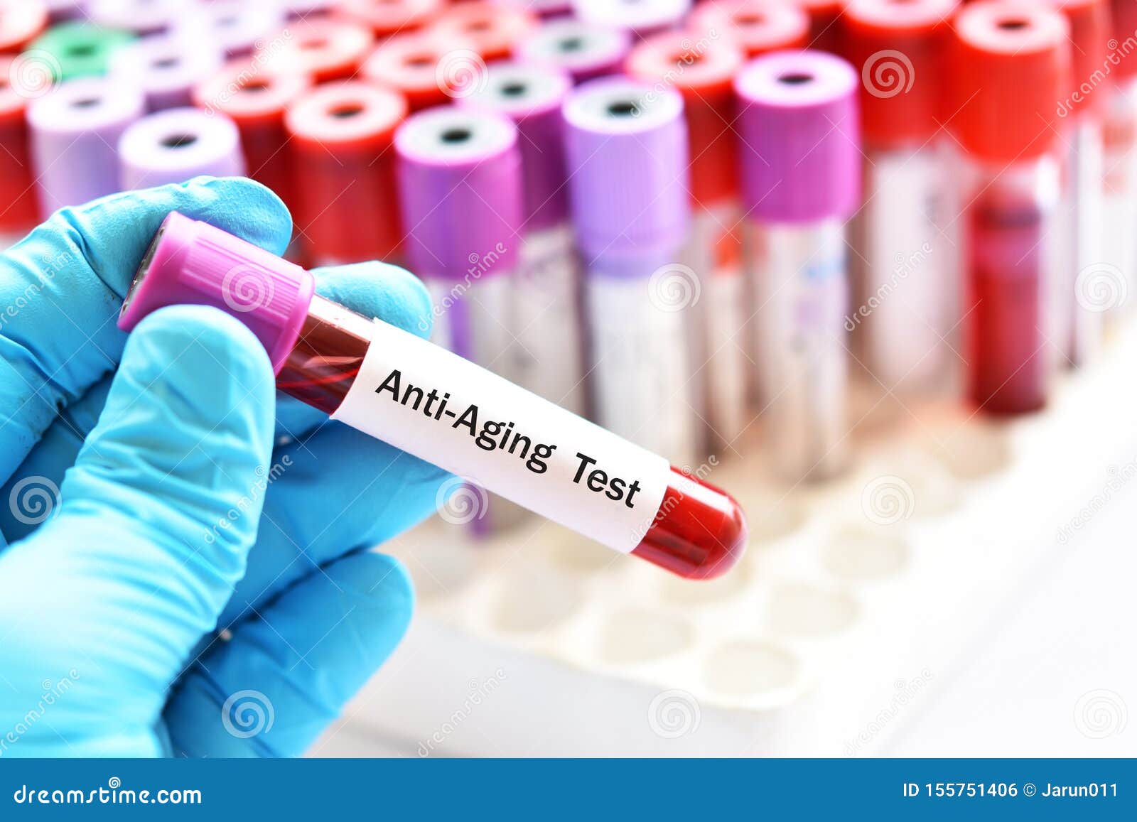 Blood Sample for Anti-aging Test Stock Photo - Image of adolescent ...