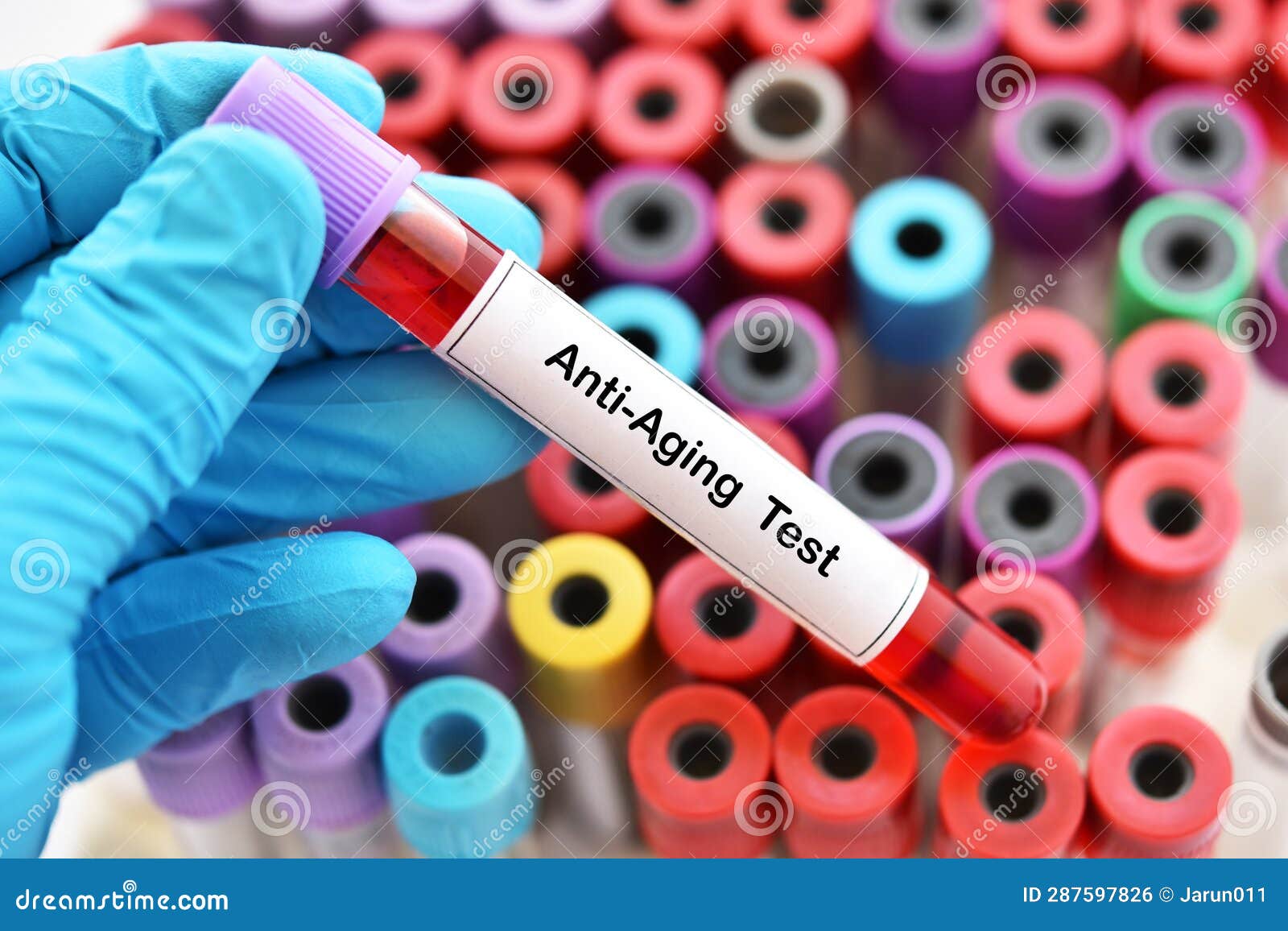 Blood Sample for Anti-aging Test Stock Photo - Image of serum ...