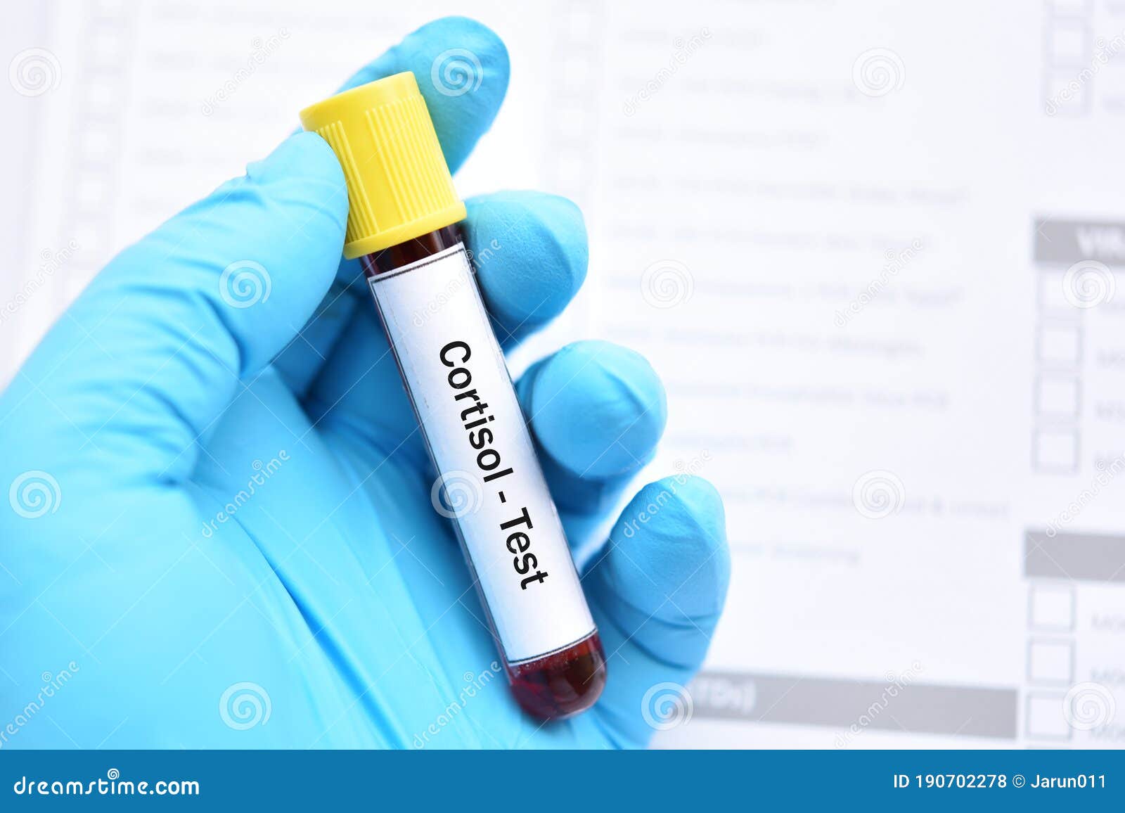 Blood for Cortisol Hormone Test Stock Photo - Image of exam, endorphins ...