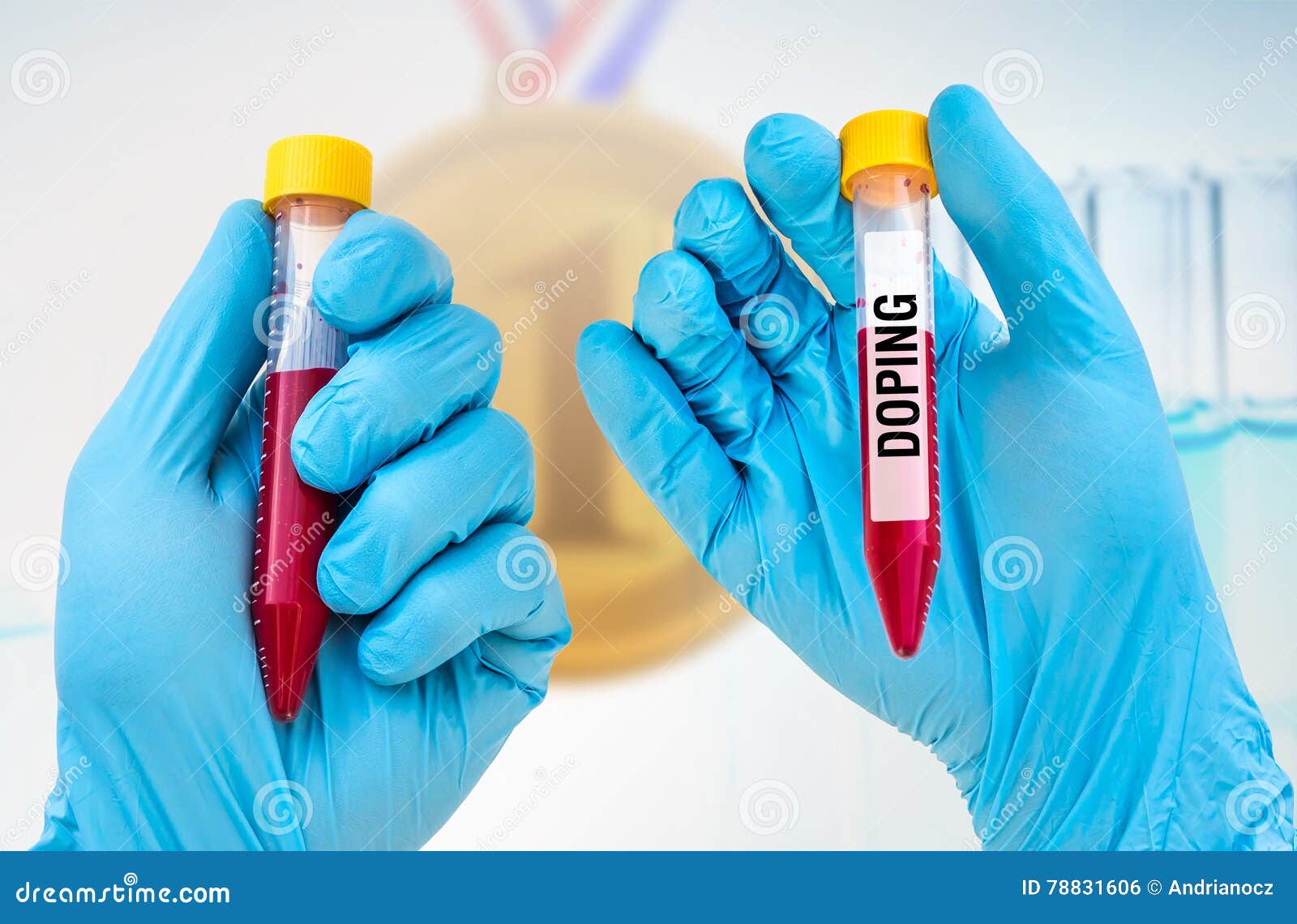 Test-tube with Blood Sample for DOPING Test Stock Photo - Image of ...