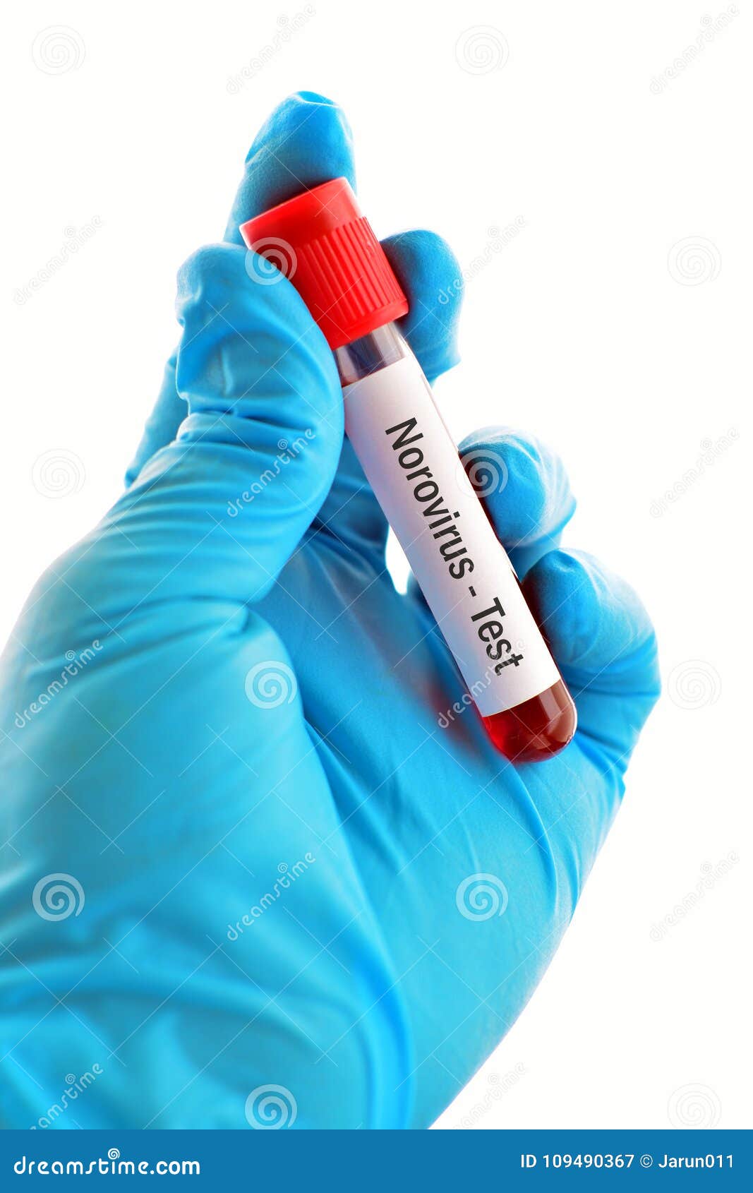Blood Sample for Norovirus Test Stock Image - Image of exam, test ...