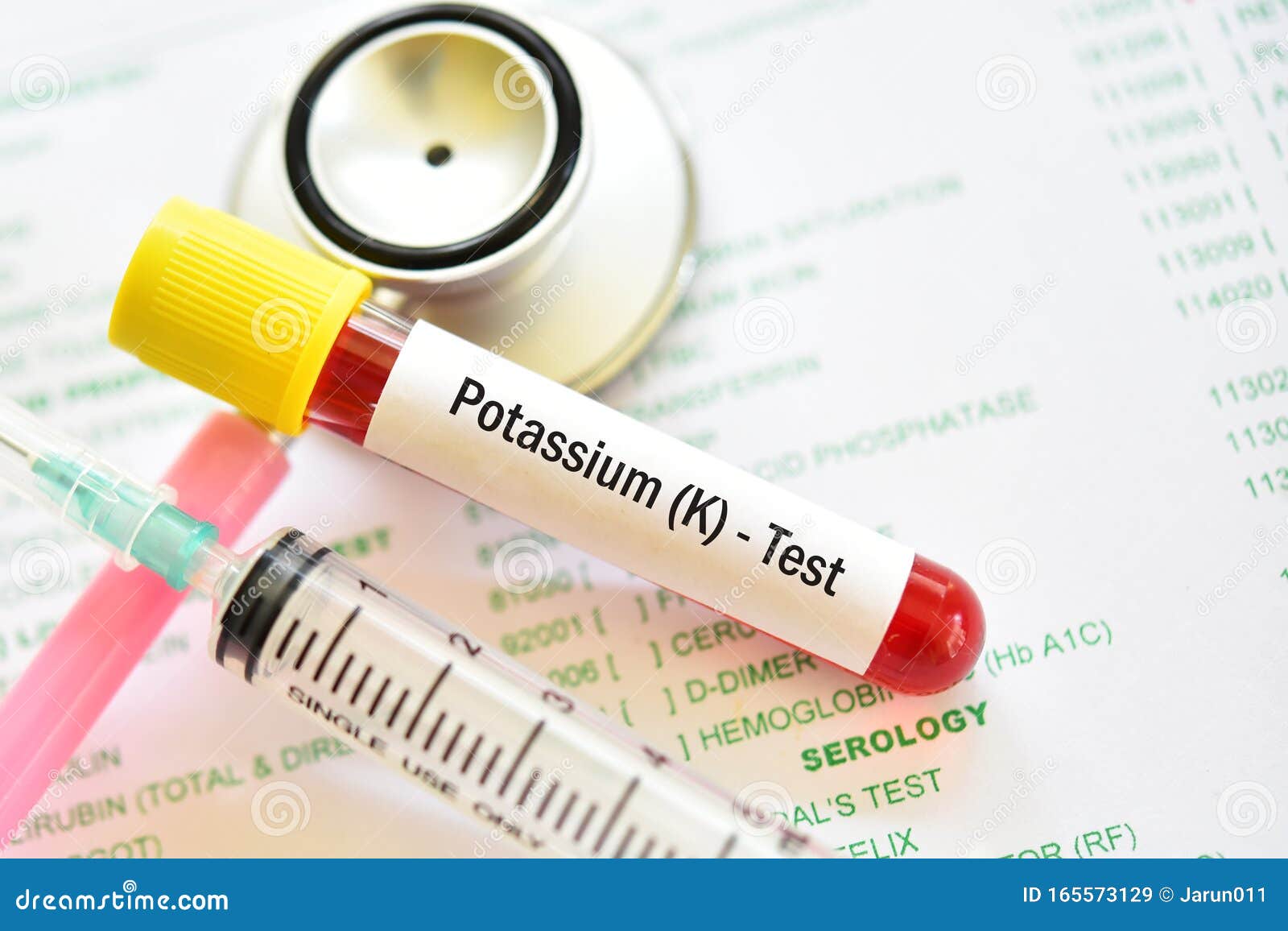 Blood Sample for Potassium Test Stock Image - Image of magnesium ... Blood Sample for Potassium Test Stock Image - Image of magnesium ...
