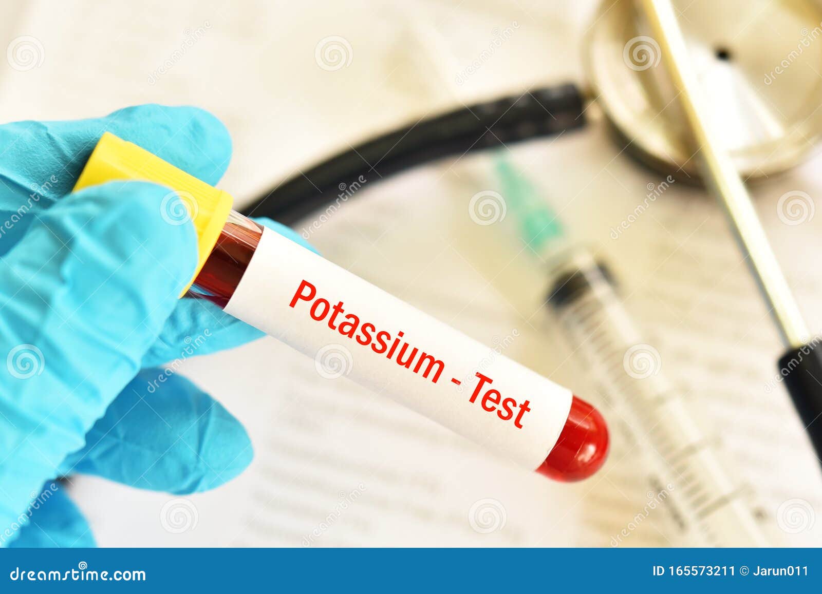 Blood Sample for Potassium Test Stock Image - Image of checkup, renal ... Blood Sample for Potassium Test Stock Image - Image of checkup, renal ...