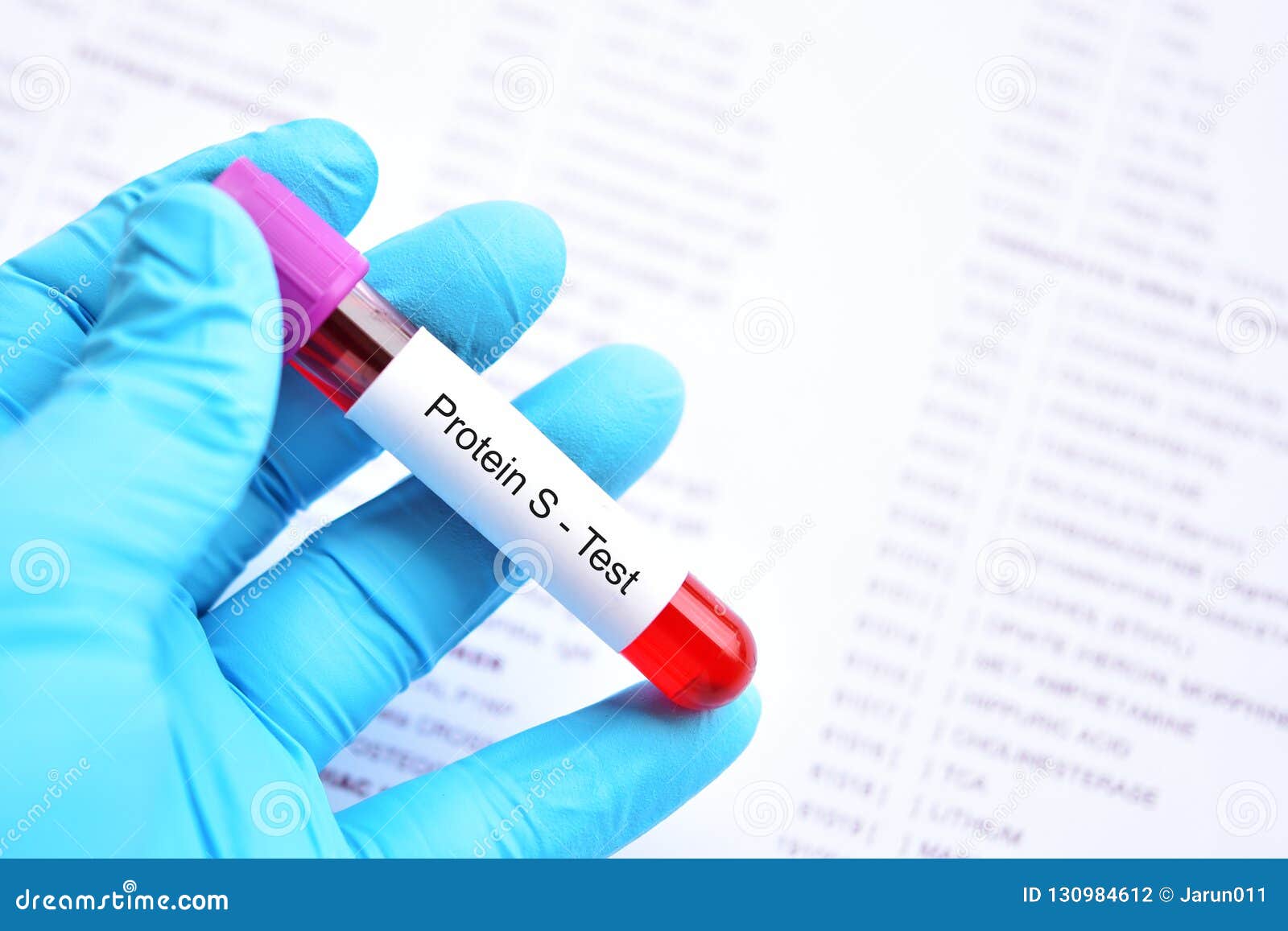 Test Tube with Blood Sample for Protein S Test Stock Photo - Image of ...