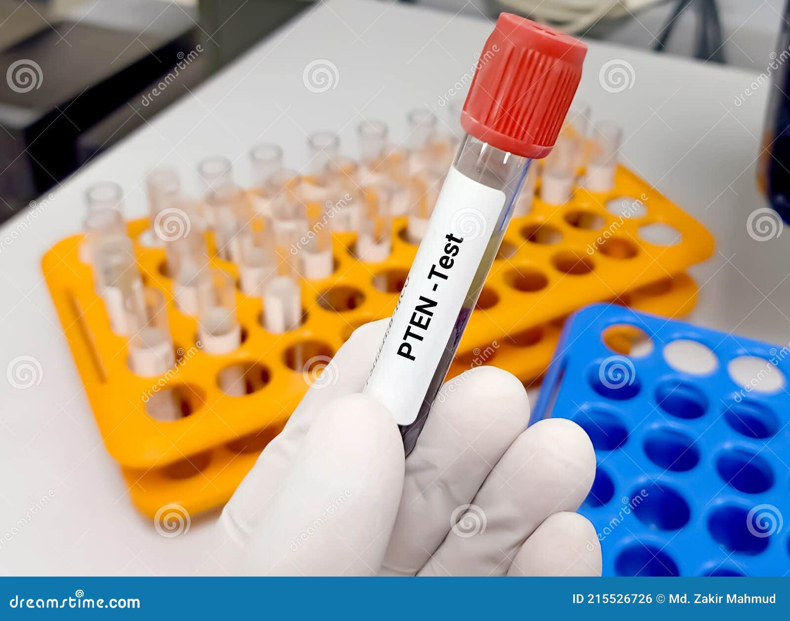 Test Tube with Blood Sample for PTEN Test. Stock Photo - Image of ...