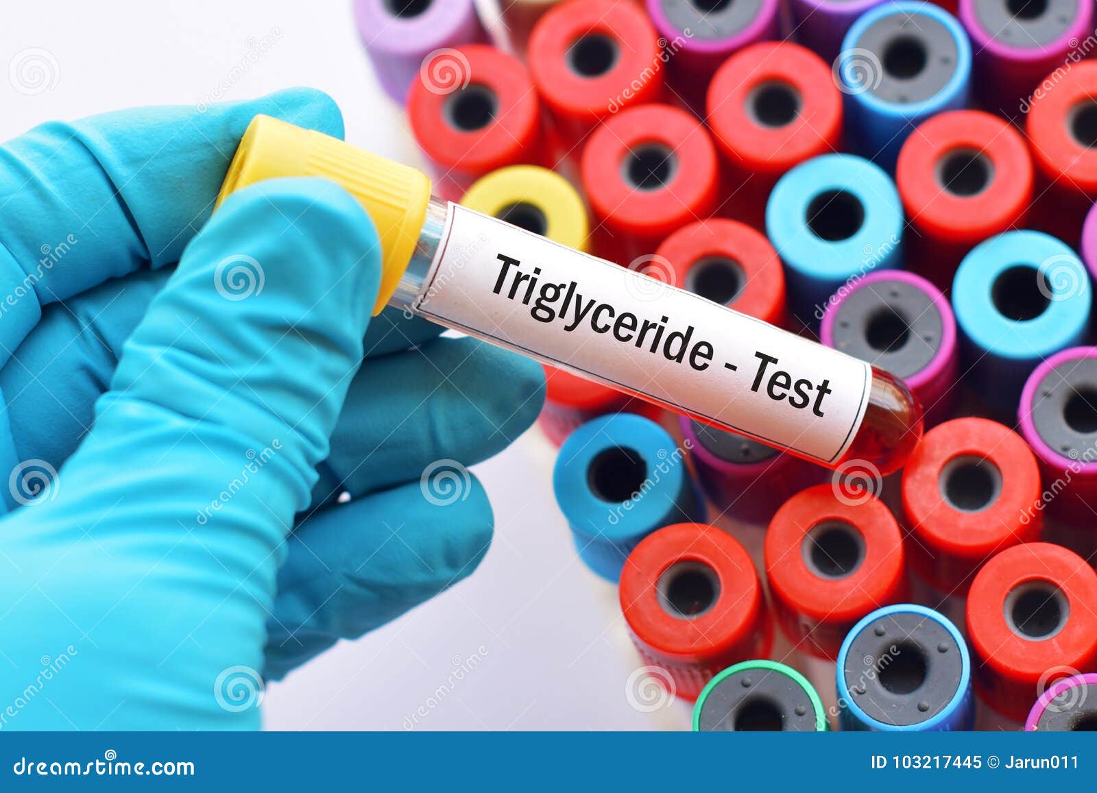 Triglyceride test stock image. Image of disease, hypertension - 103217445