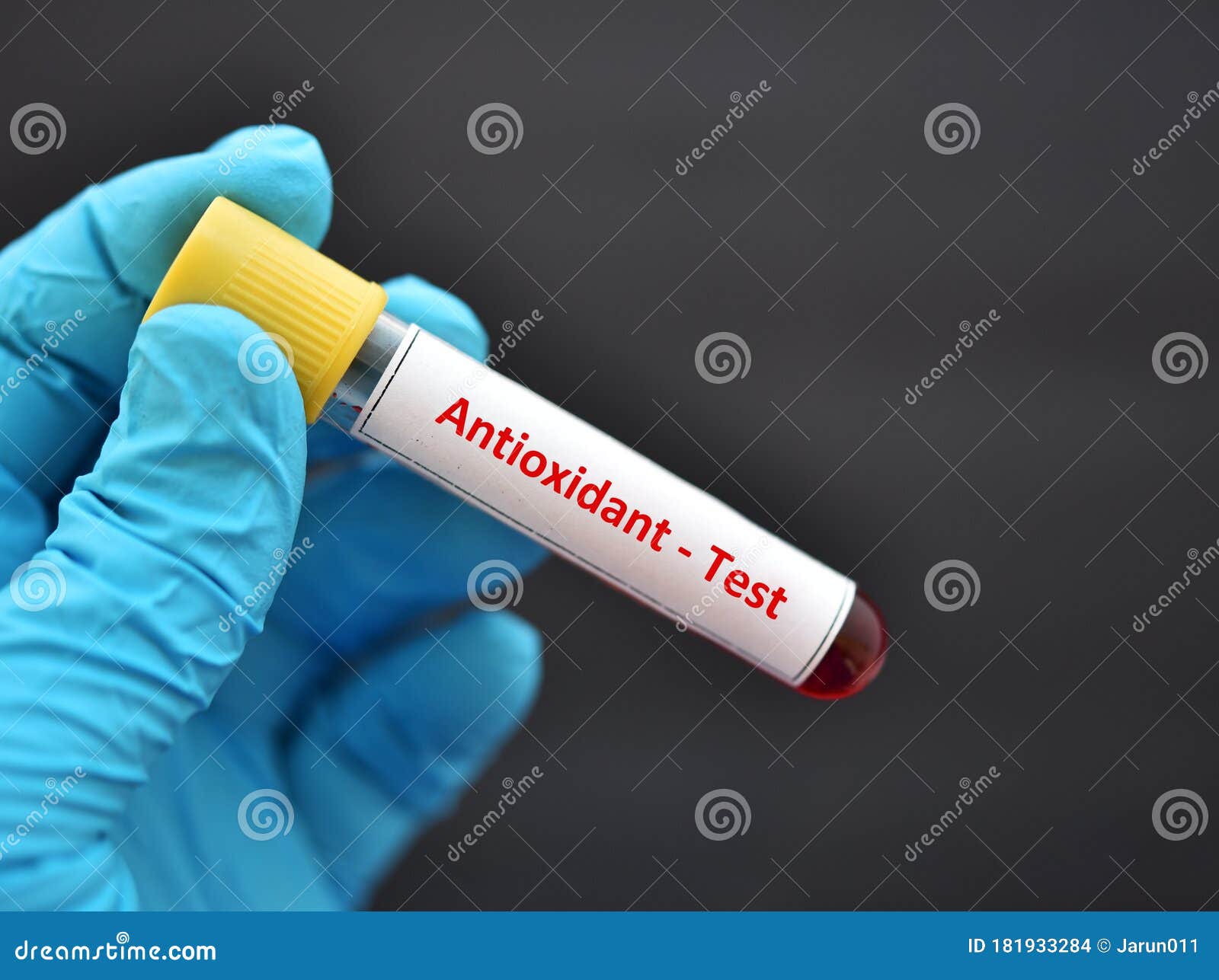 Blood Sample for Antioxidant Test Stock Photo - Image of analysis ...
