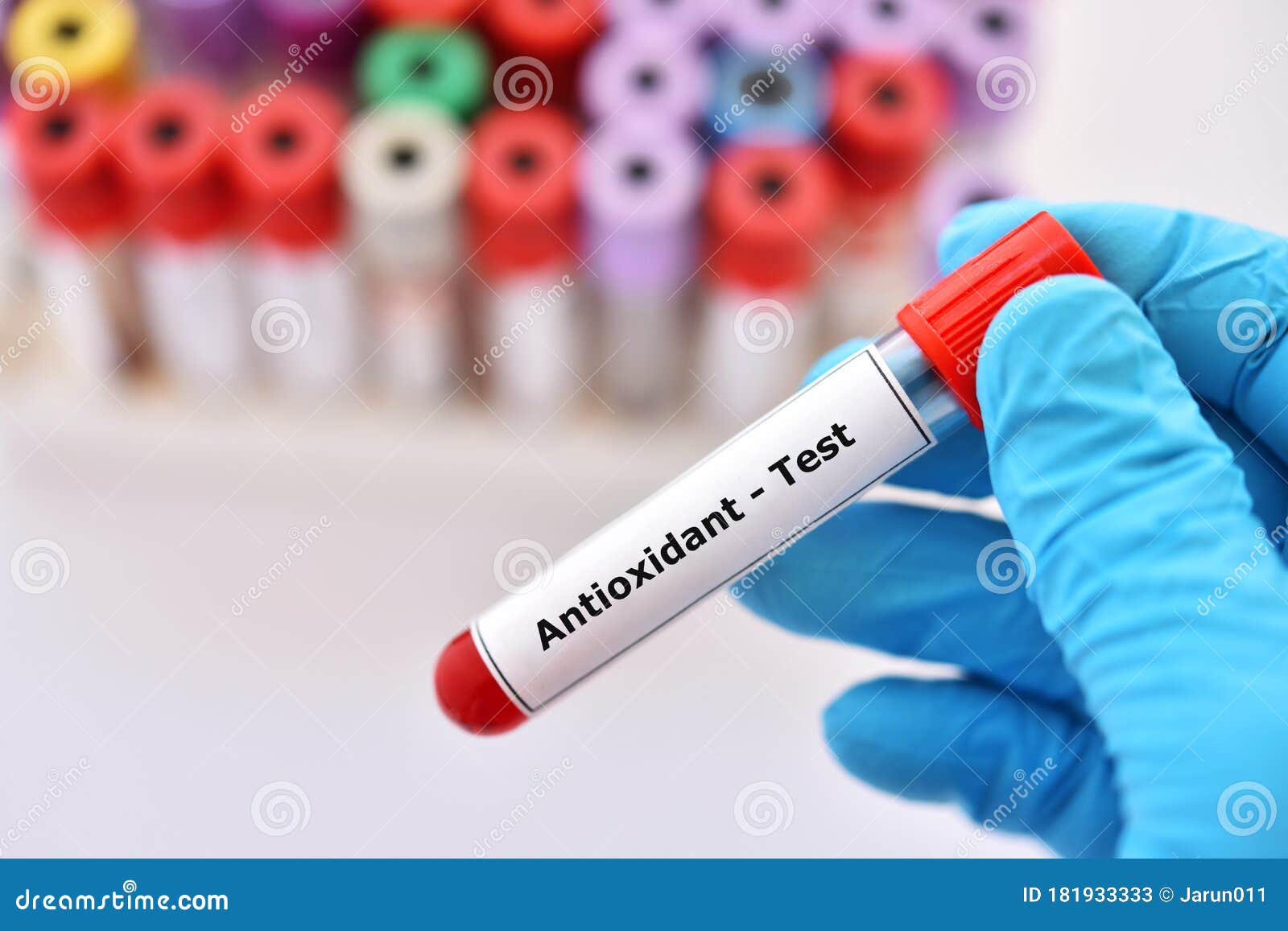 Blood Sample for Antioxidant Test Stock Image - Image of beautiful ...