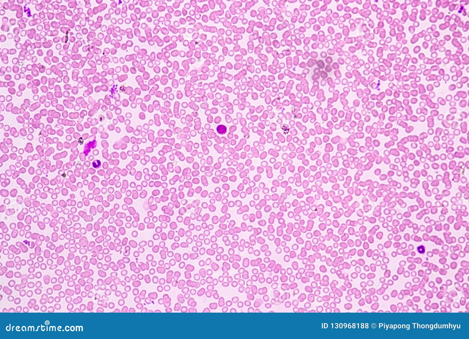 White Blood Cells are the Cells of the Immune System Under the ...