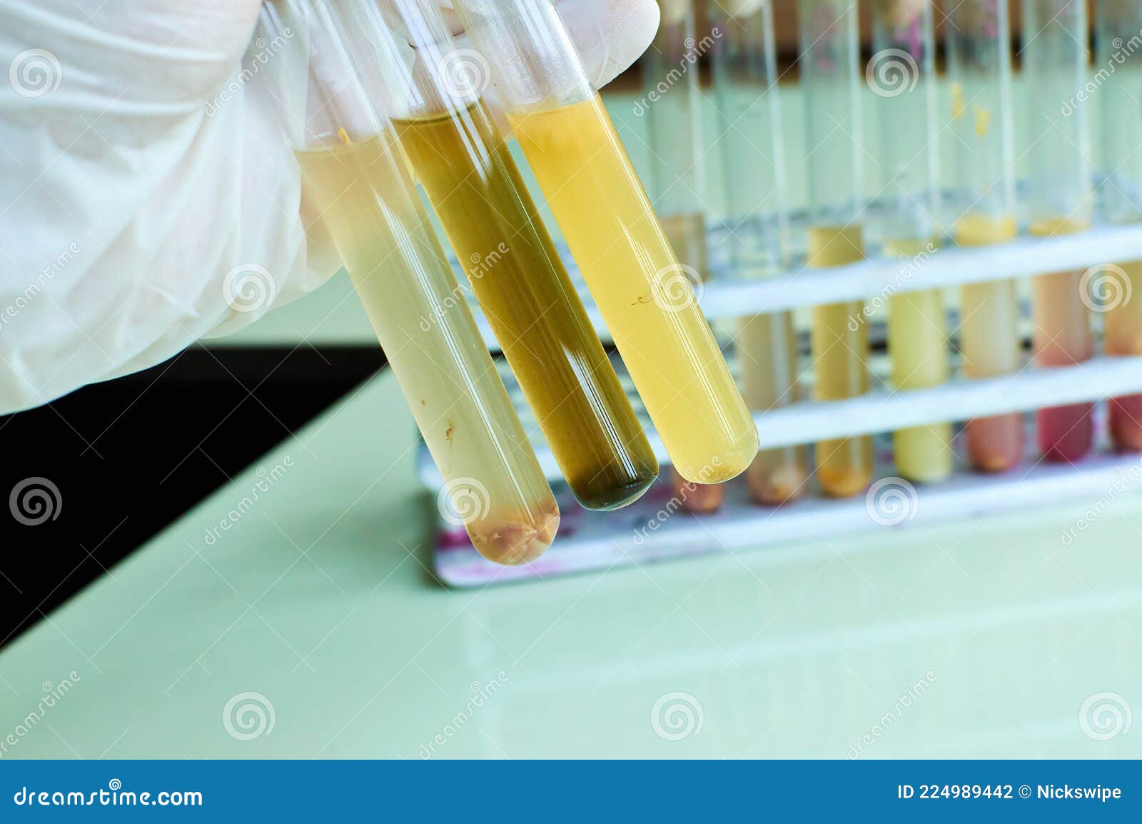 Test Tube with Sample in Pre Enrichment Medium Collected from Animals ...