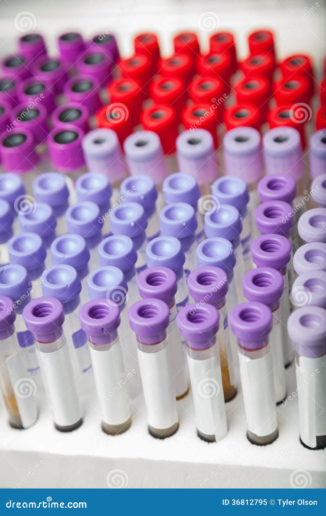Test Tubes with Barcodes in Laboratory Stock Image - Image of scientist ...