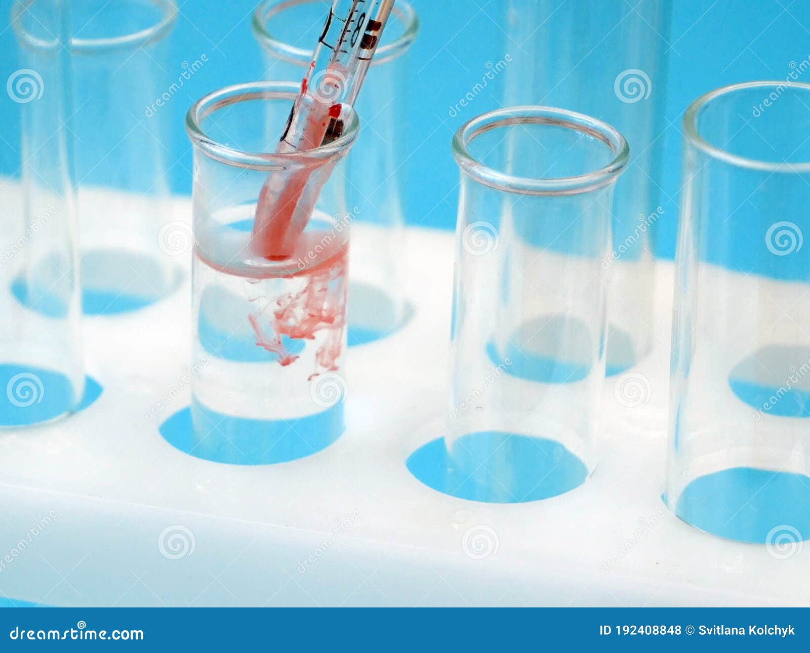 Test Tubes with Blood Sample in Laboratory Stock Photo - Image of ...