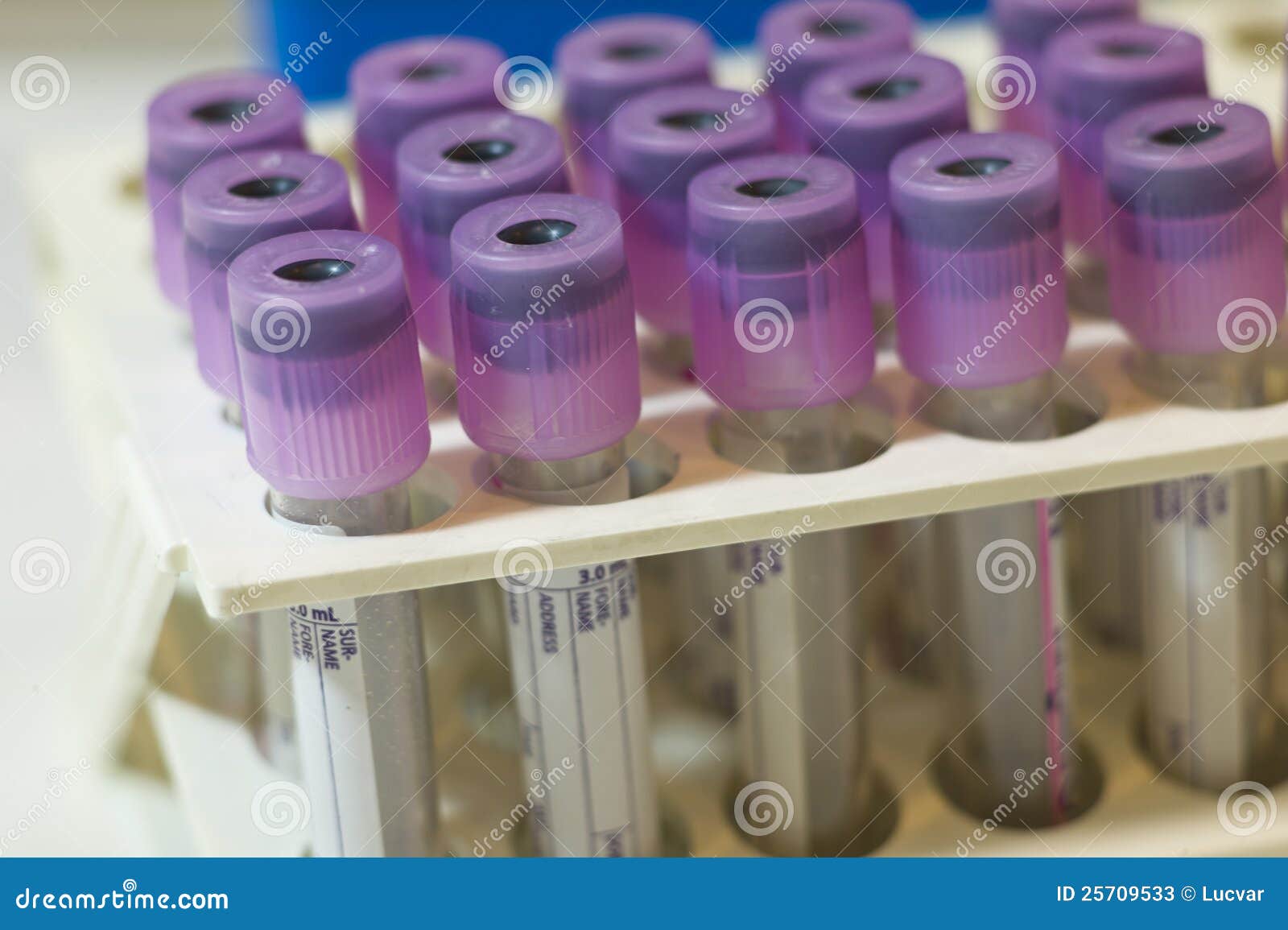 Test Tubes for Blood Samples Stock Image - Image of research, chemistry ...