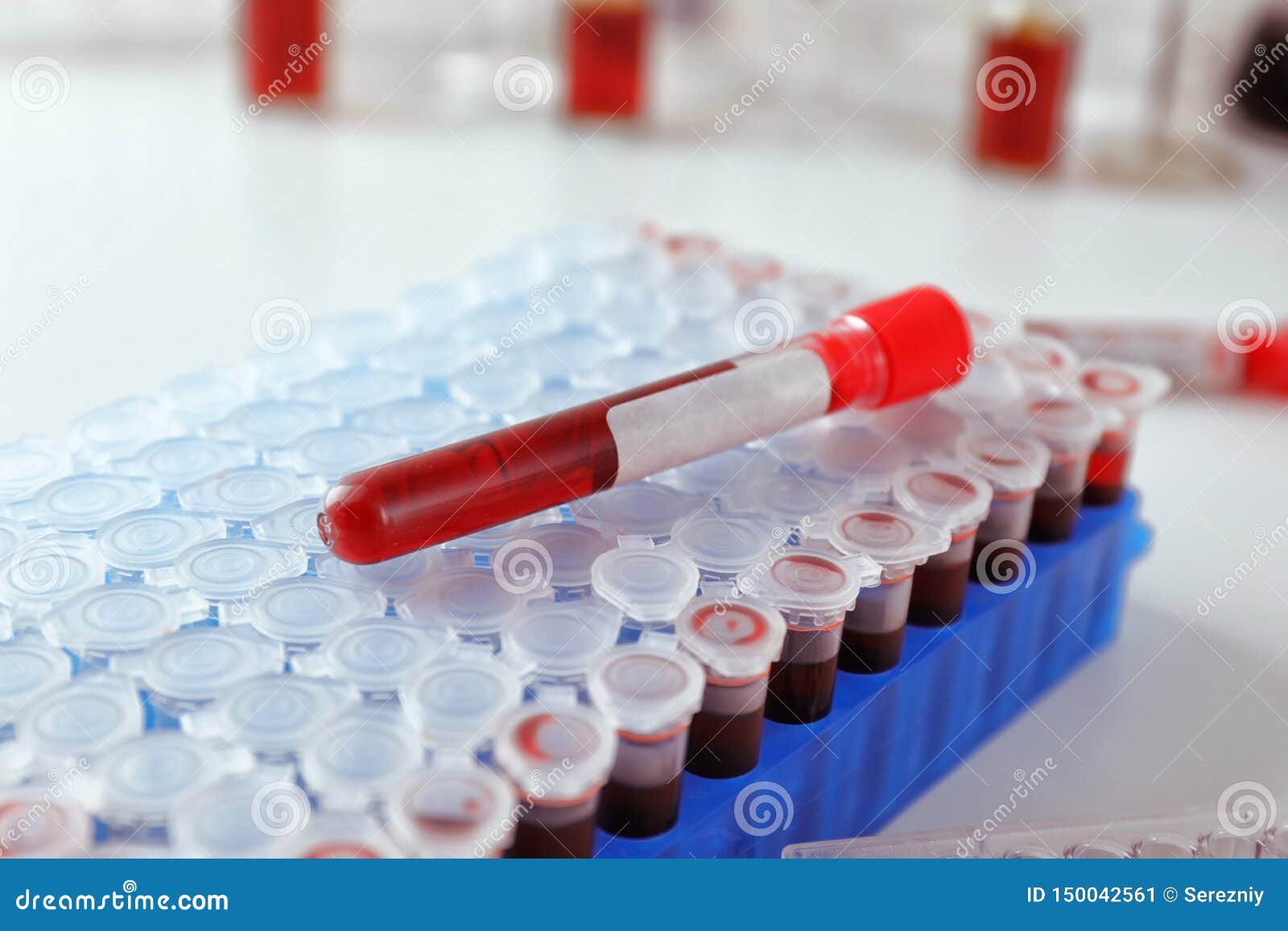 Test Tubes with Blood Samples in Holder, Closeup Stock Image - Image of ...