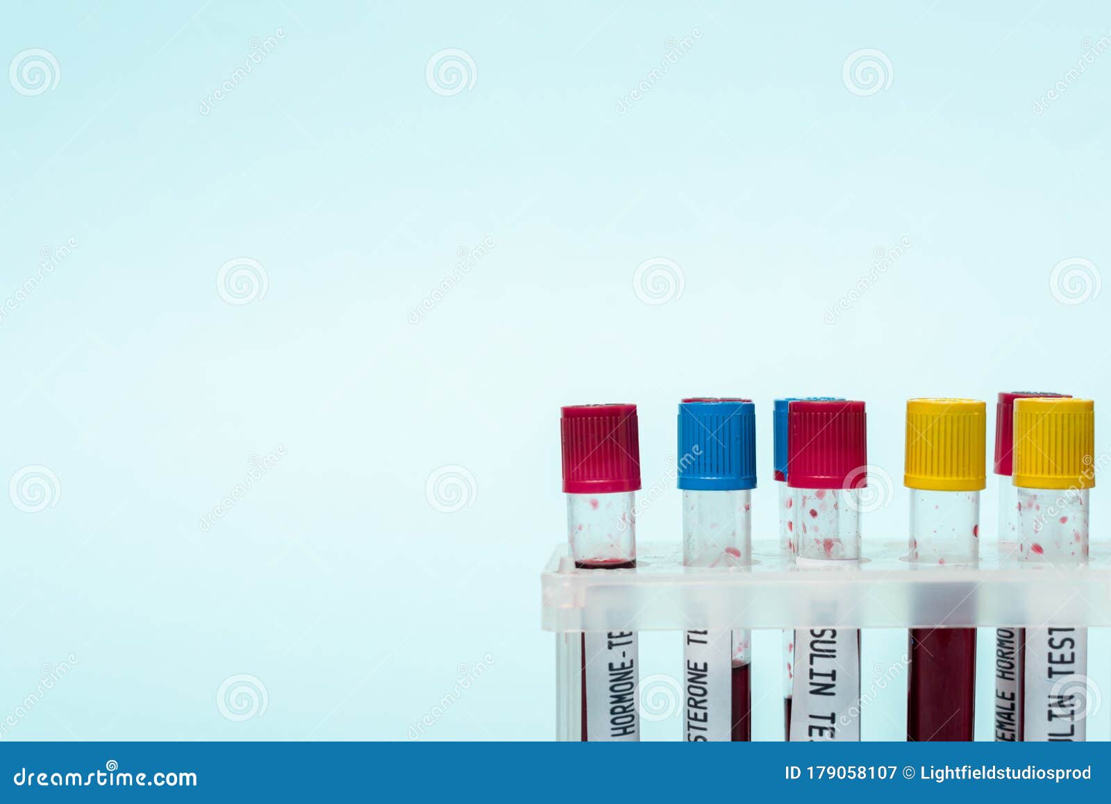Tubes with Blood Samples of Hormones Stock Image - Image of ...