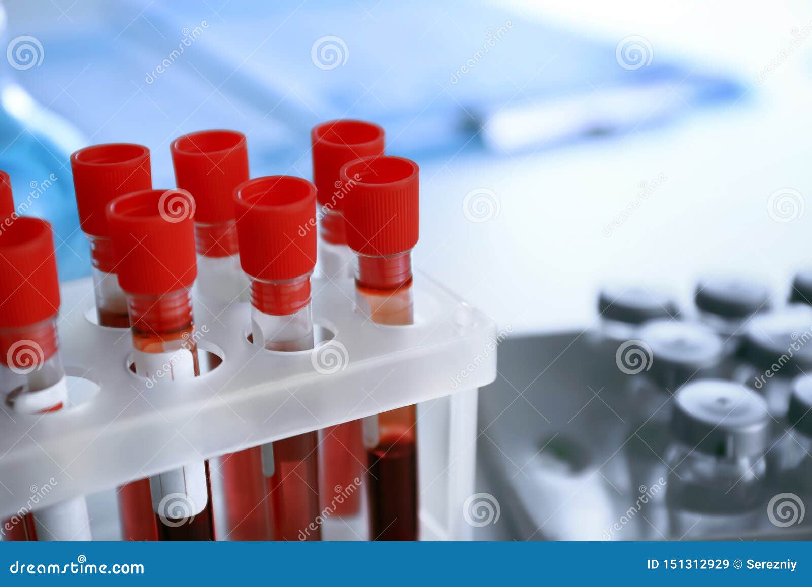 Test Tubes with Blood Samples on Table in Laboratory, Closeup Stock ...