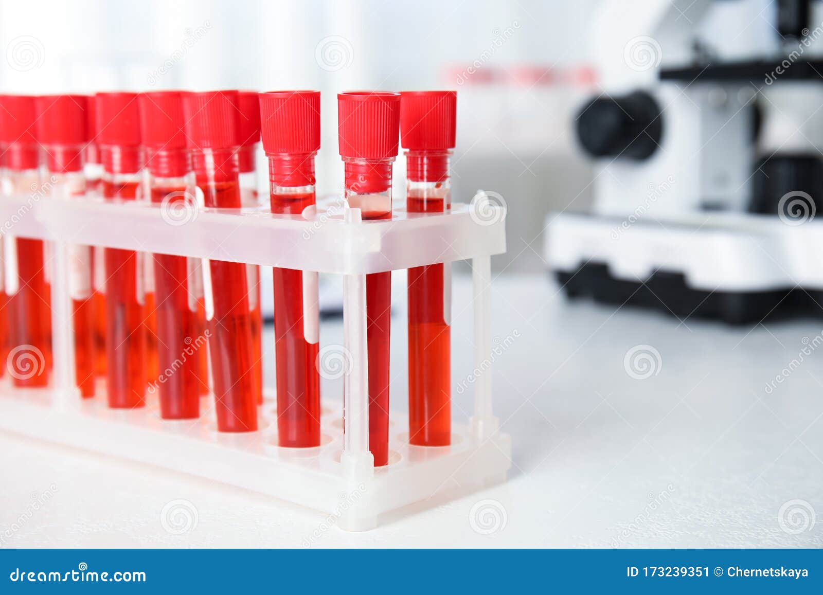 Test Tubes with Blood Samples on Table in Laboratory. Virus Research ...