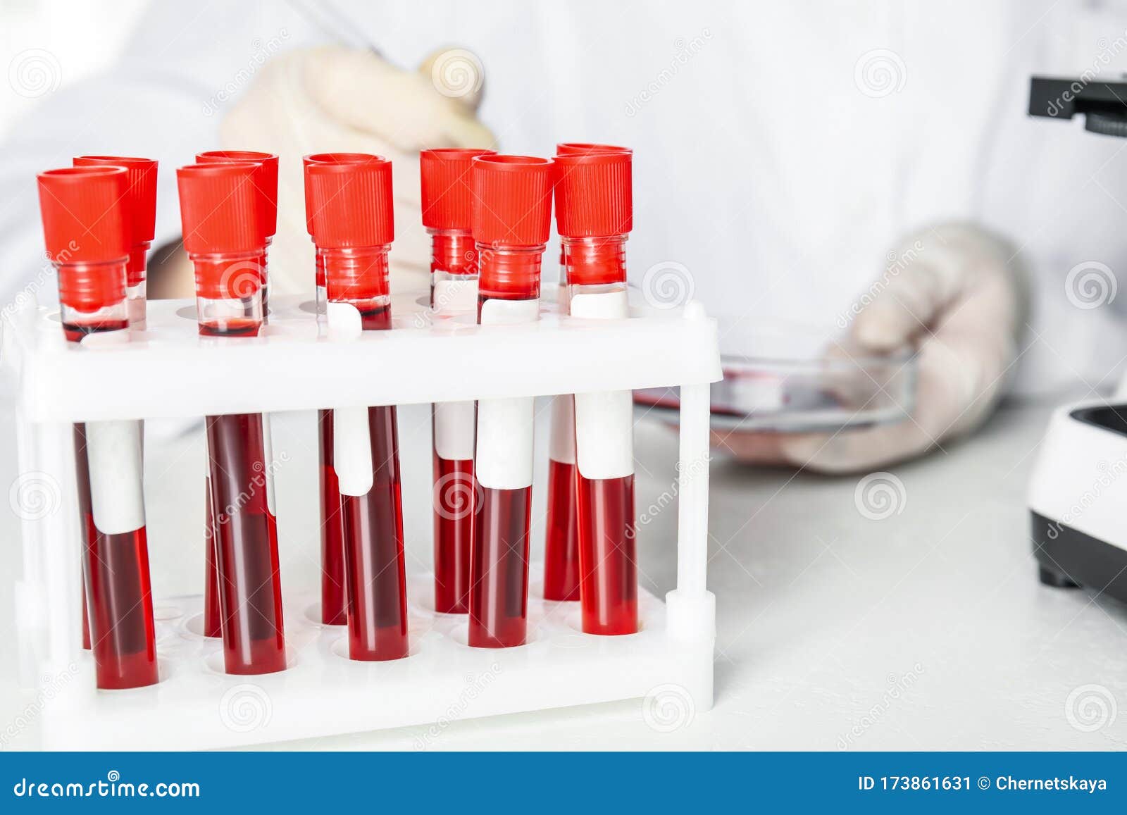 Test Tubes with Blood Samples on Table in Laboratory. Virus Research ...