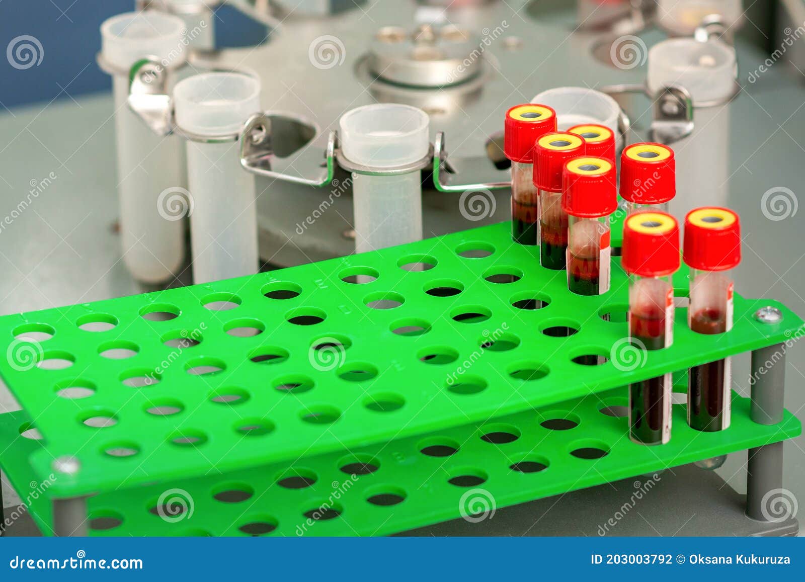 Test Tubes with Blood Samples Stock Photo - Image of biochemistry ...