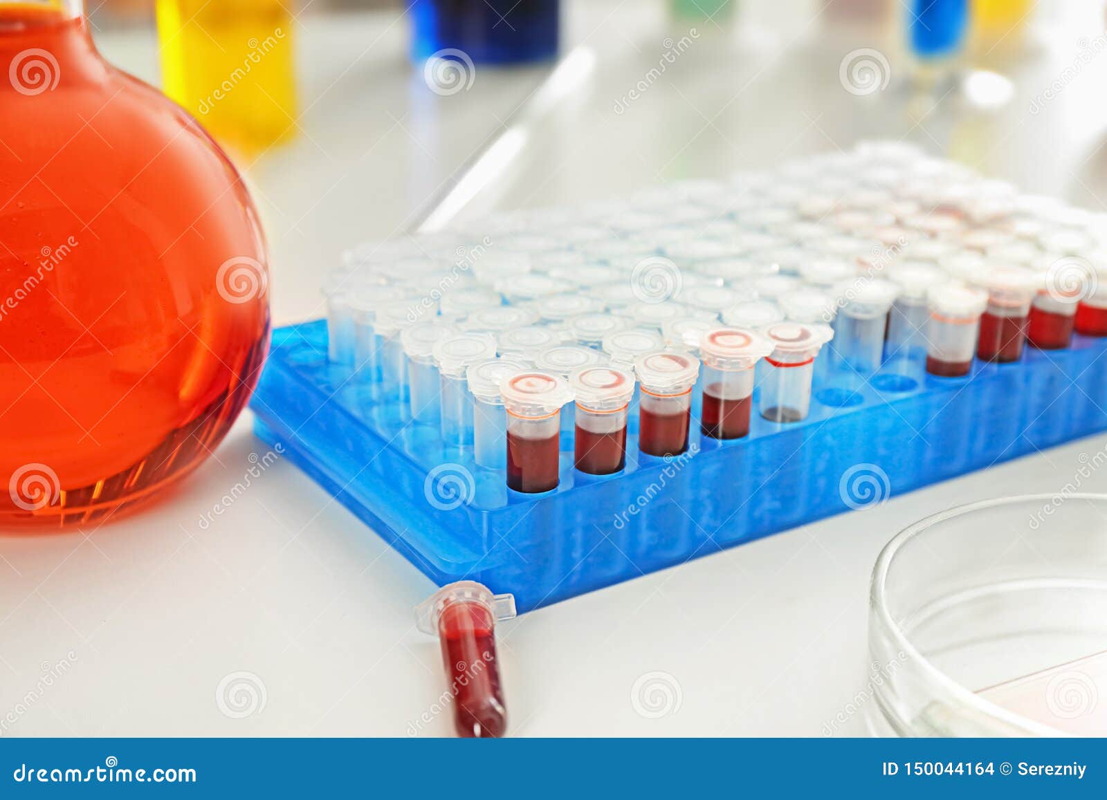Test Tubes with Blood on Table Stock Photo - Image of medicine, flask ...