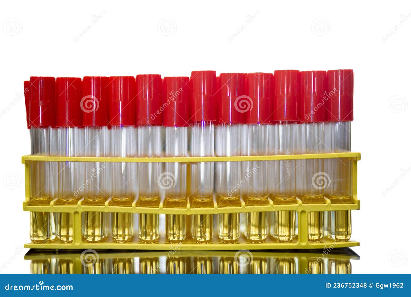 Test Tubes Containing Media Stock Photo - Image of experiment, medical ...