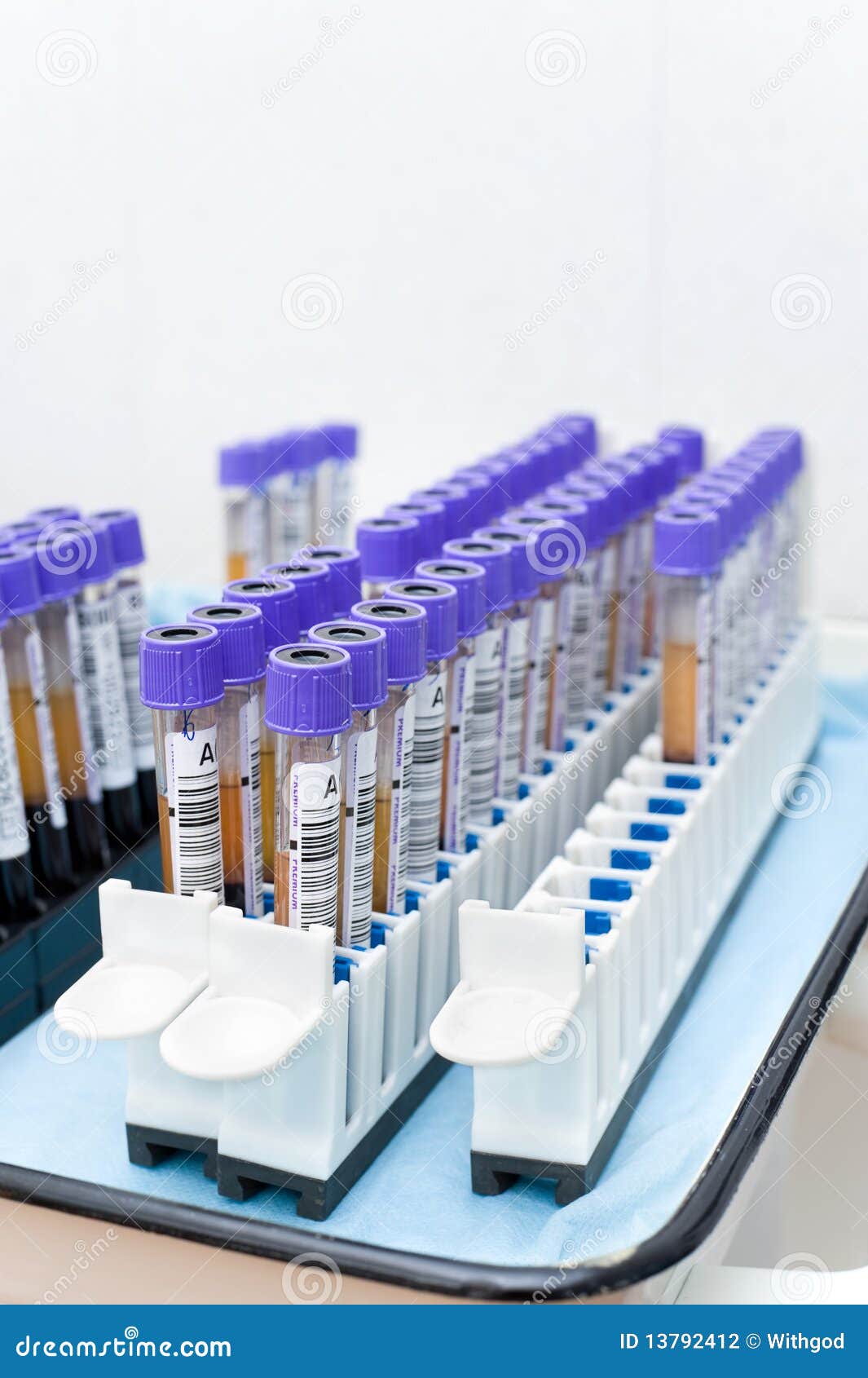 Test Tubes with Donor Blood Stock Photo - Image of probe, group: 13792412