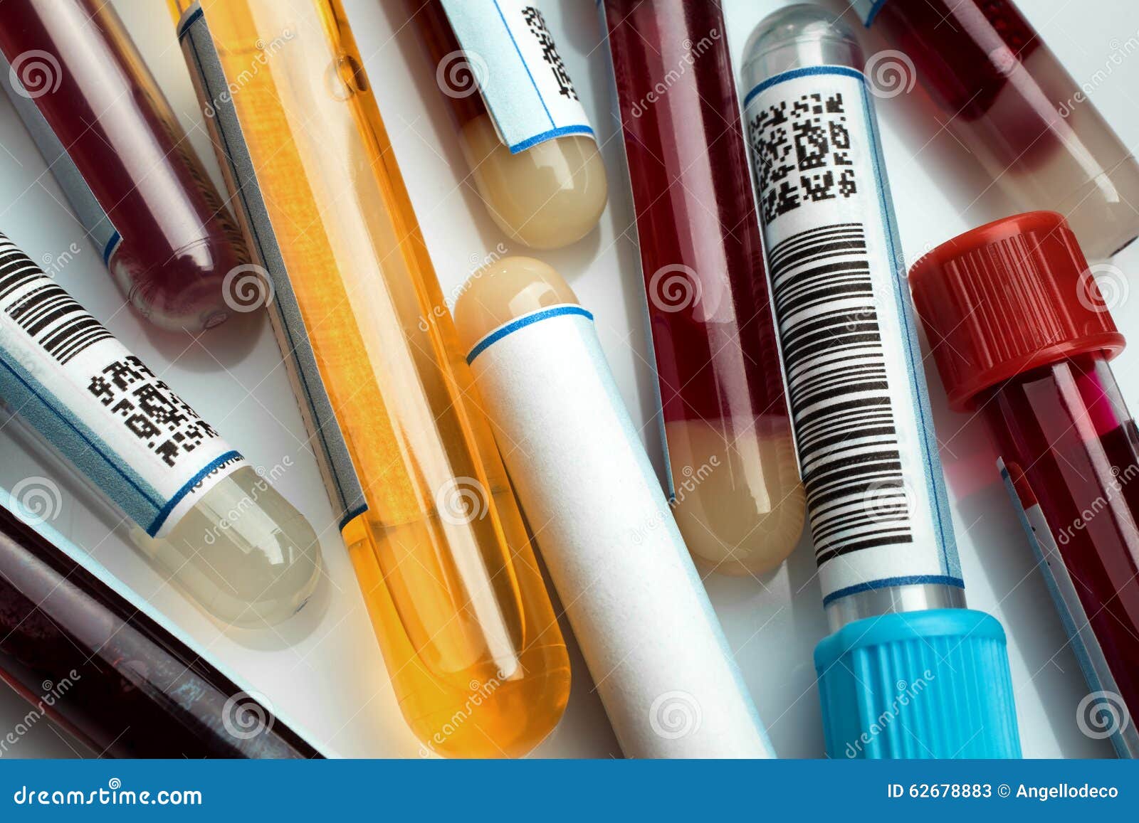 Test tubes in laboratory stock image. Image of examine - 62678883